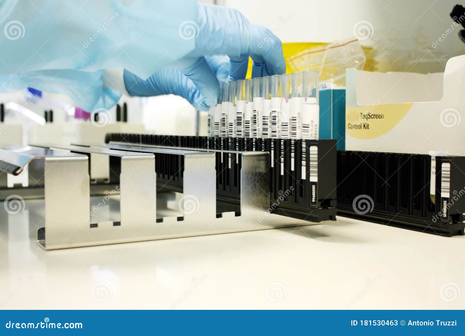 Rack with Test Tubes of Blood Editorial Stock Photo - Image of hospital ...