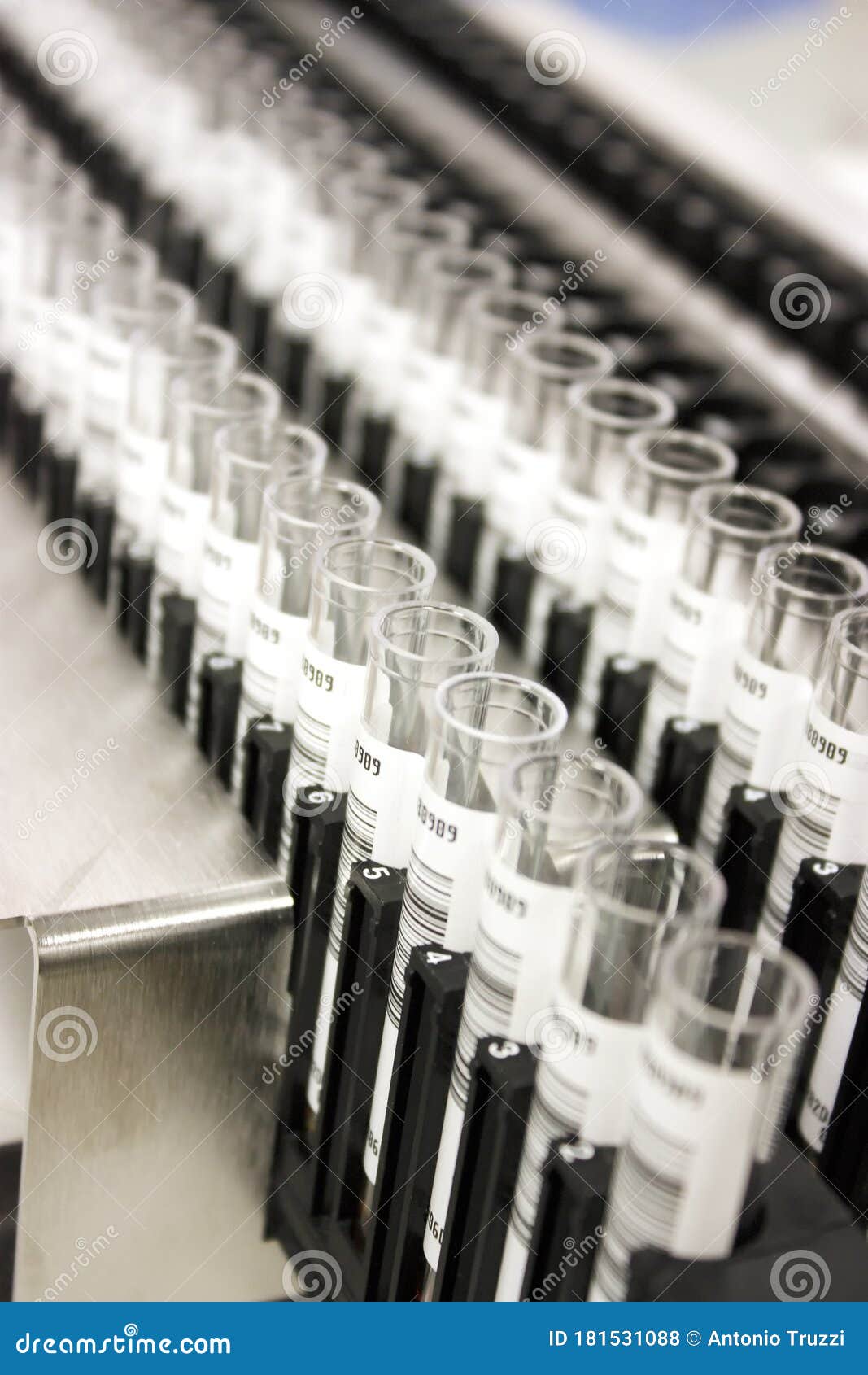 Rack with Test Tubes of Blood Editorial Stock Photo - Image of medical ...