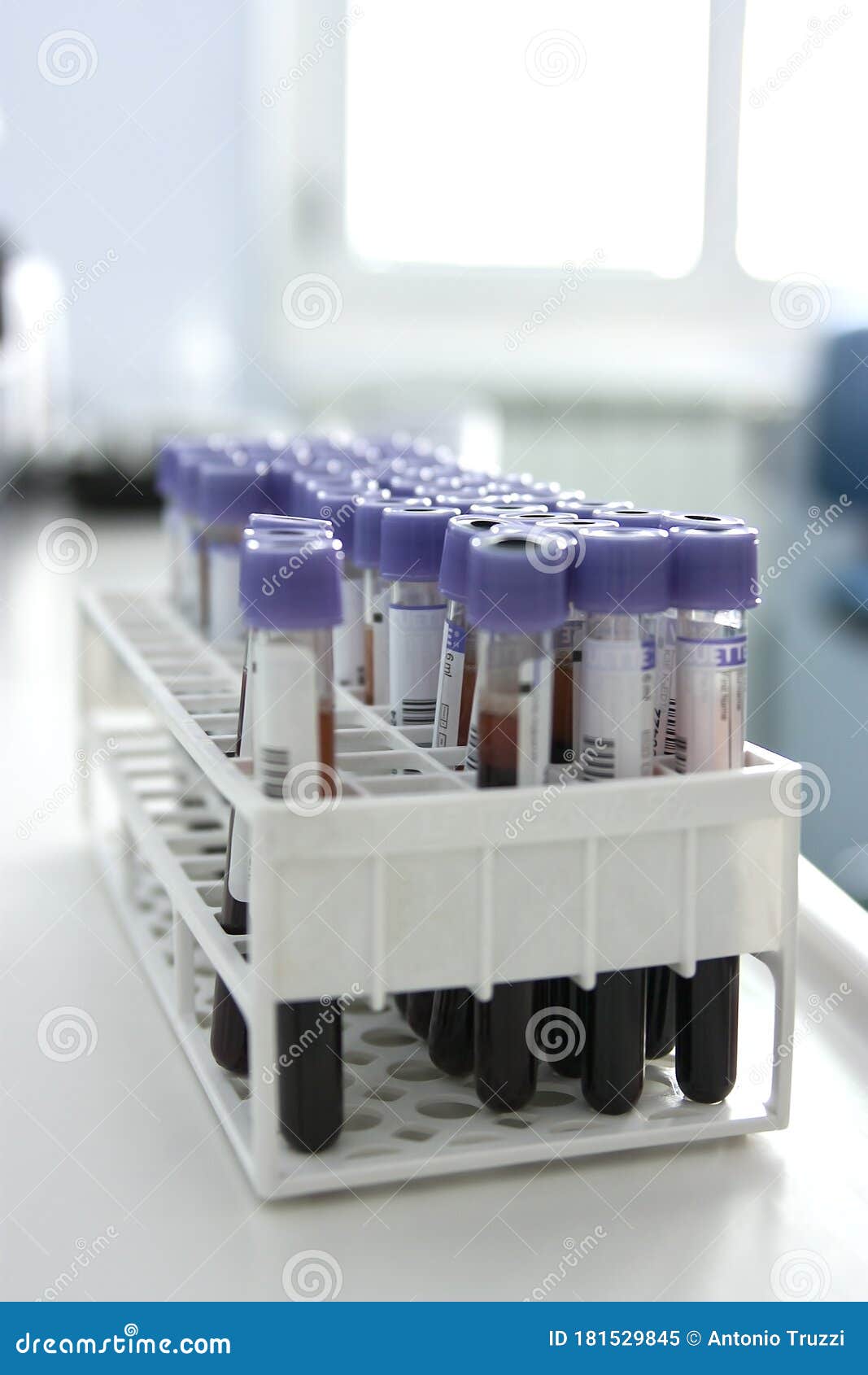 Rack with Test Tubes of Blood Editorial Image - Image of business, help ...