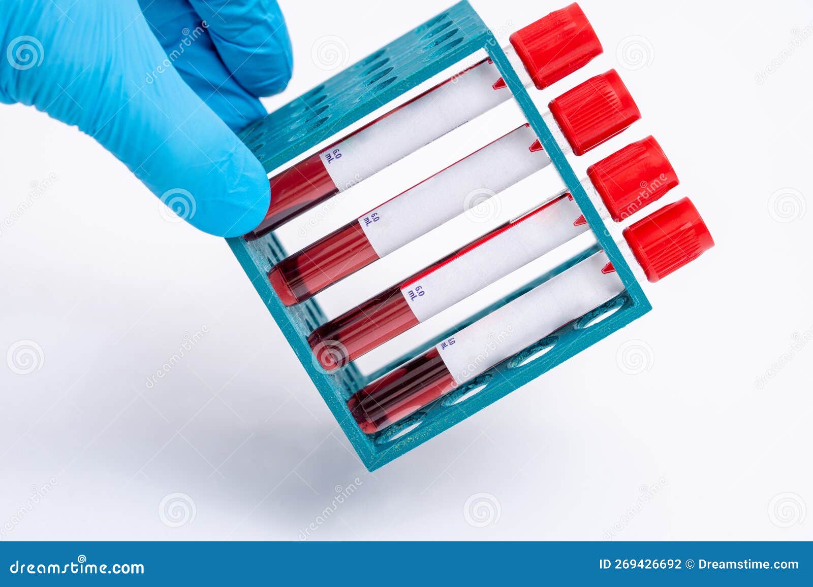 Rack with Test Tubes of Blood Samples for Biochemical Analysis in a ...