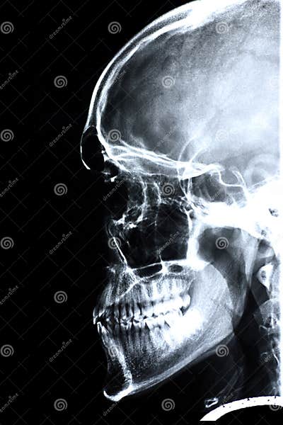 Radiografía/de cara mayor imagen de archivo. Imagen de rayo - 198831