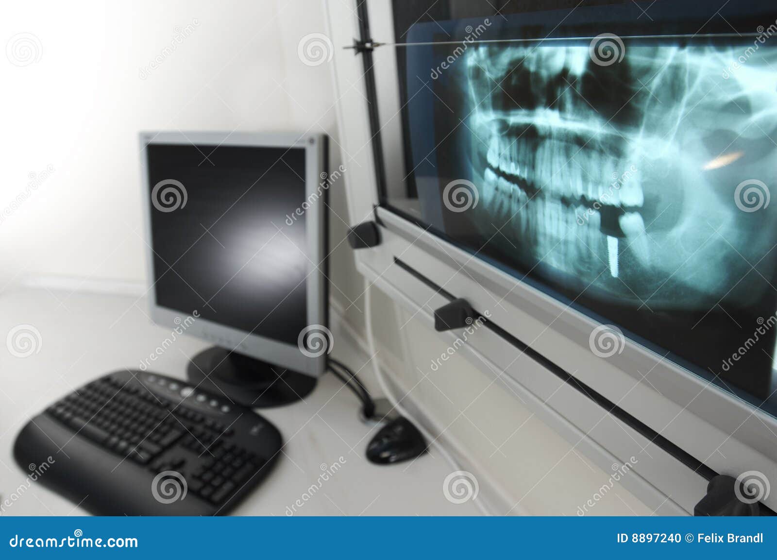 Radiograph Royalty-Free Stock Photo | CartoonDealer.com #17093607