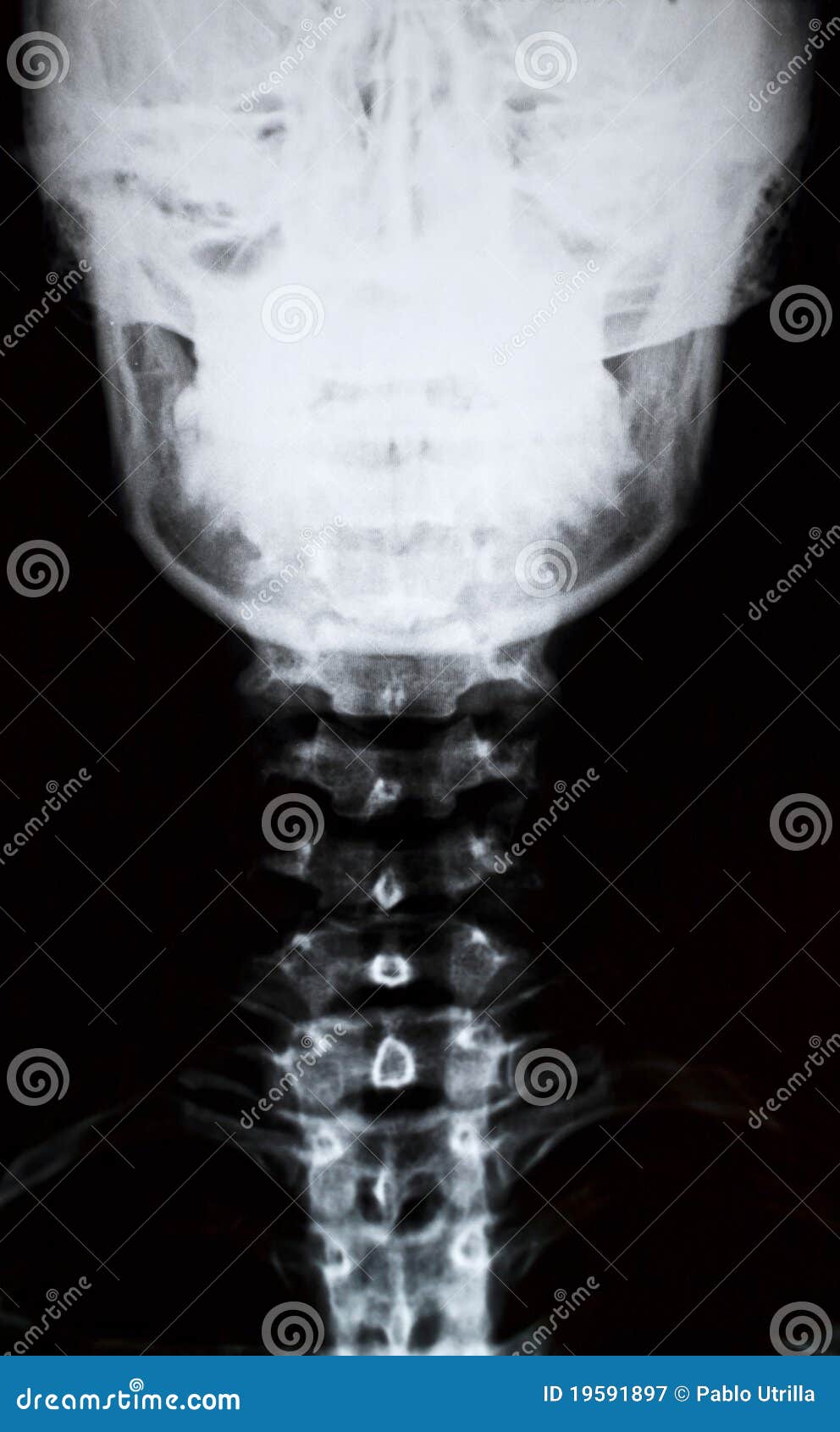 Radiograph stock image. Image of radiograph, bones, exploration - 19591897