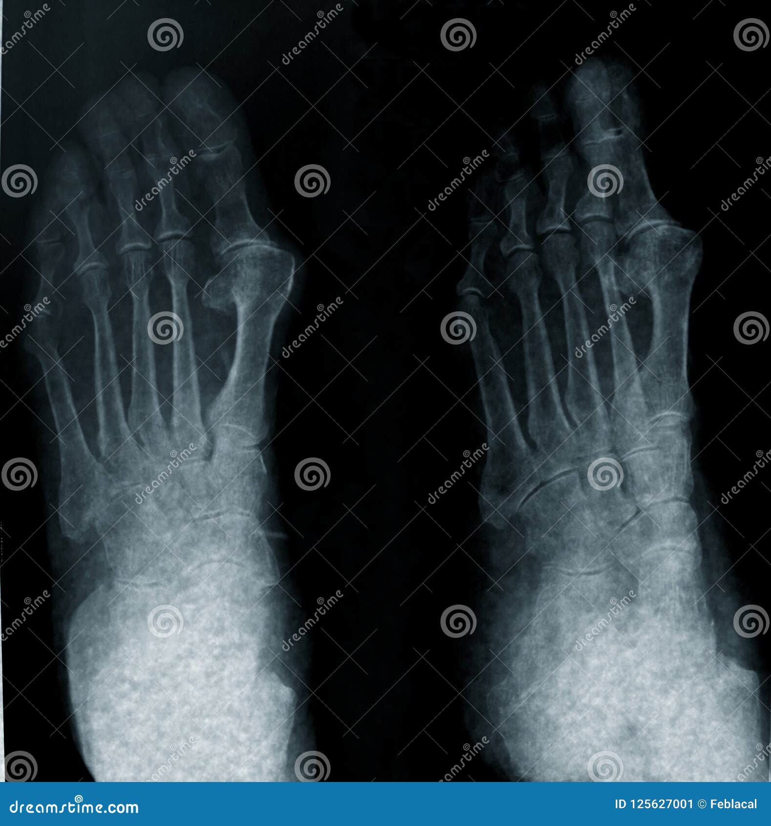 371 Radiographie De Pied Photos libres de droits et gratuites de Dreamstime