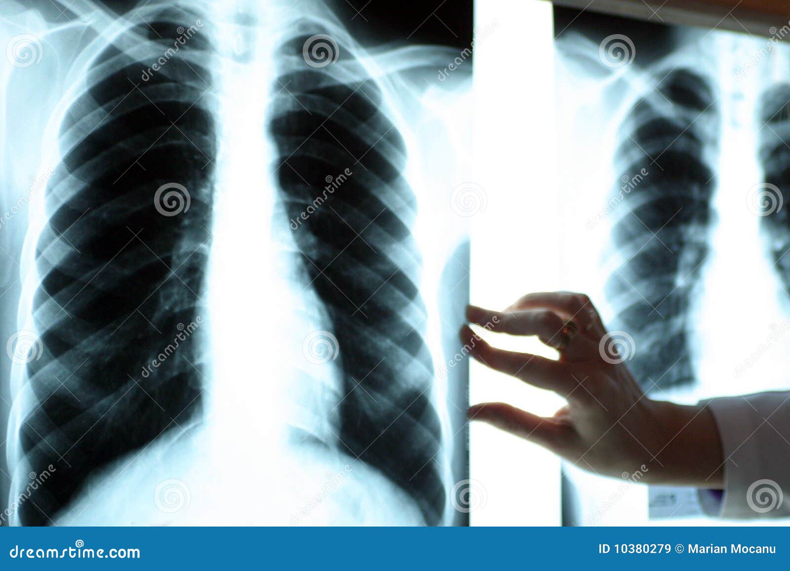 Radiography stock image. Image of work, abdominal, danger - 10380279