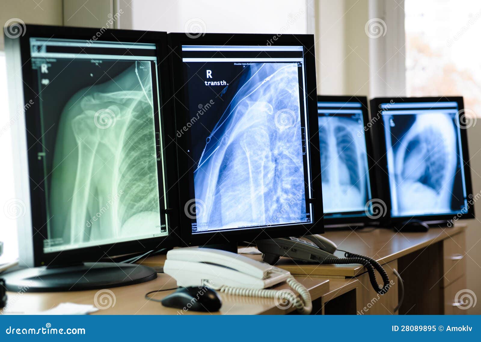 Radiography stock image. Image of office, electronics - 28089895