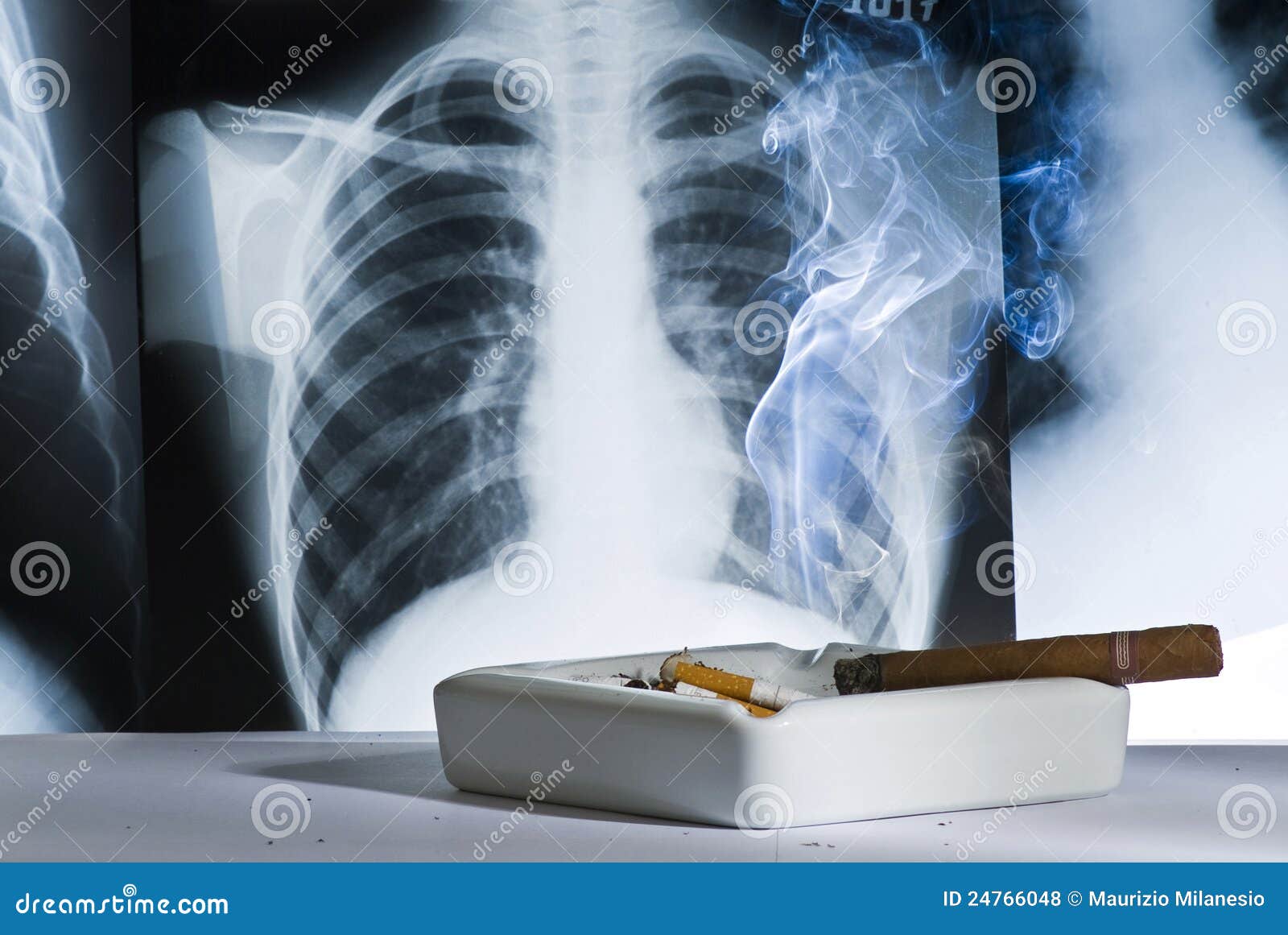 Radiography and cigarettes stock photo. Image of health - 24766048