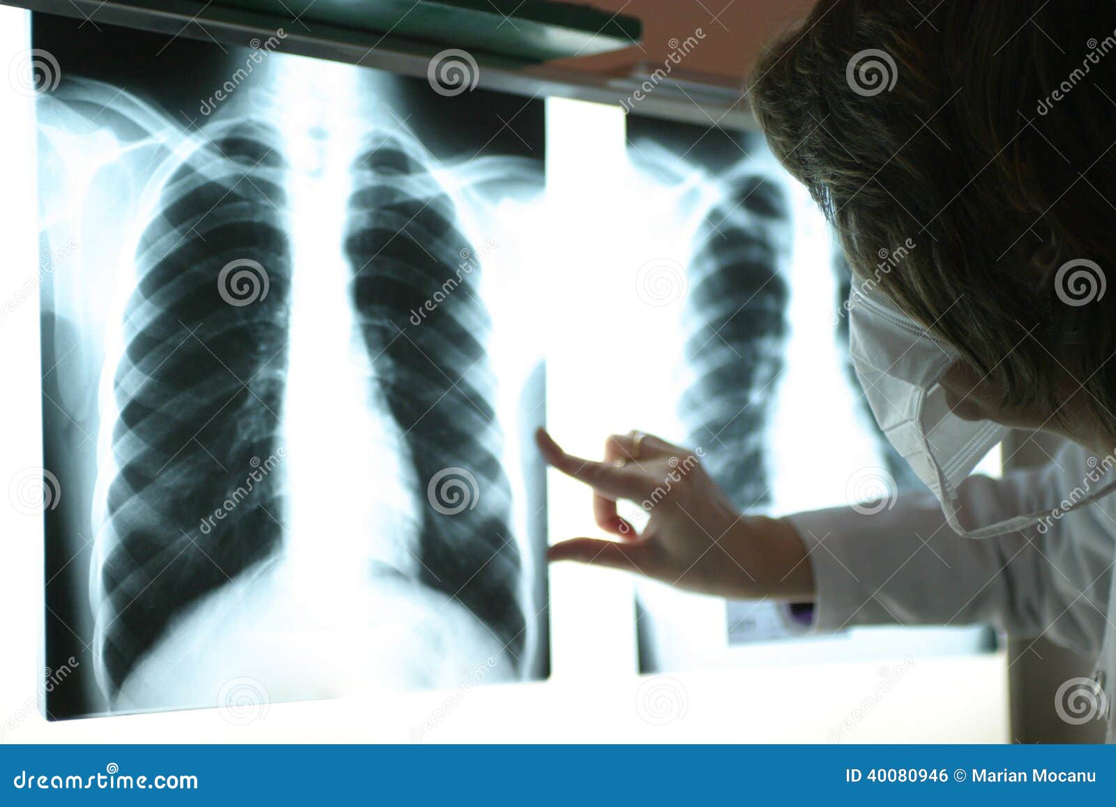 Radiography stock photo. Image of look, doctor, abdominal - 40080946