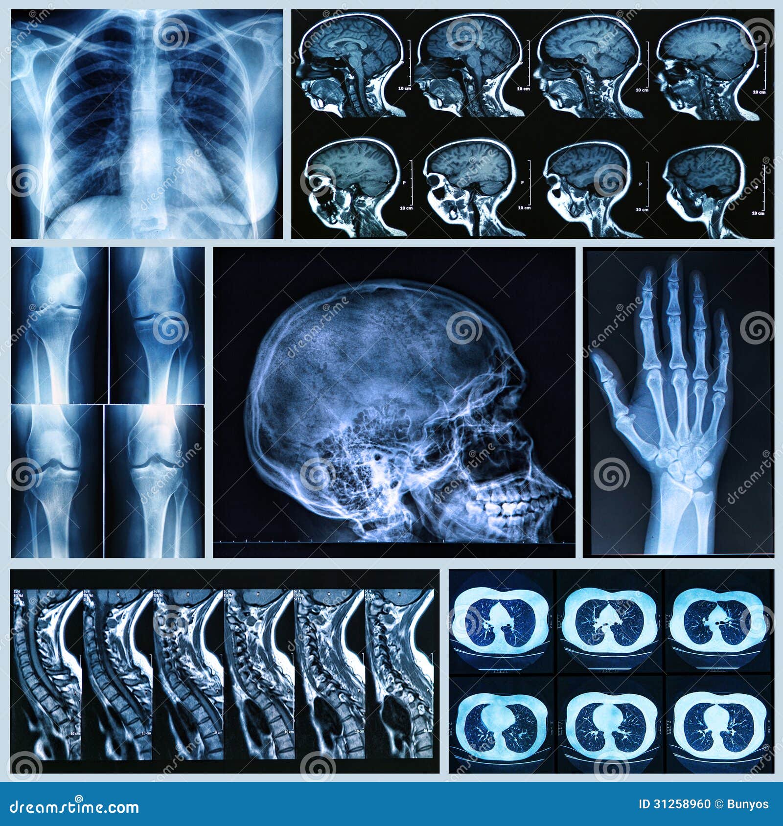 Radioactive Bones Stock Photos - Free & Royalty-Free Stock Photos from ...
