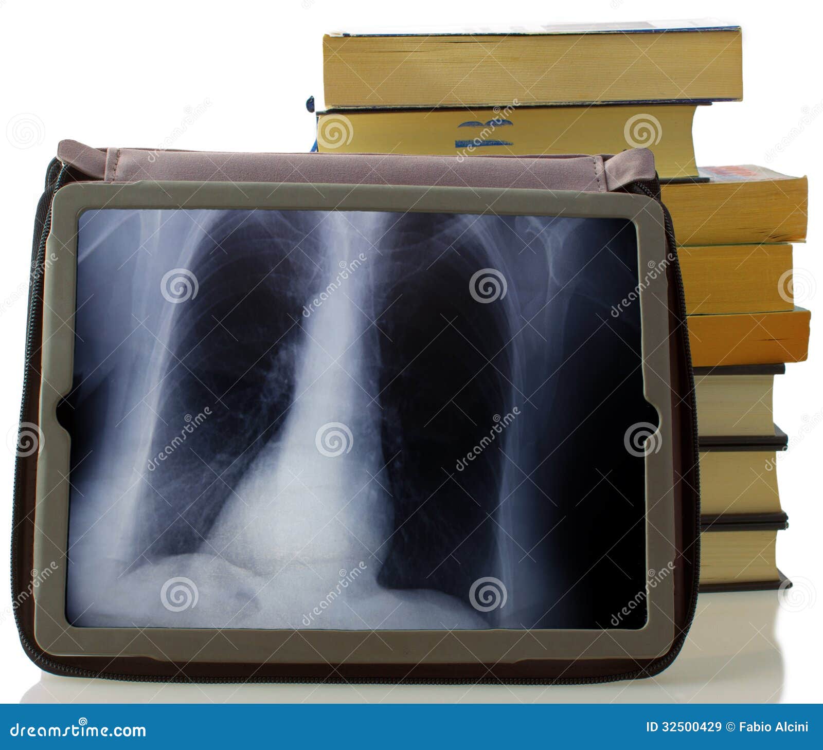 Radiography stock image. Image of table, modern, information - 32500429