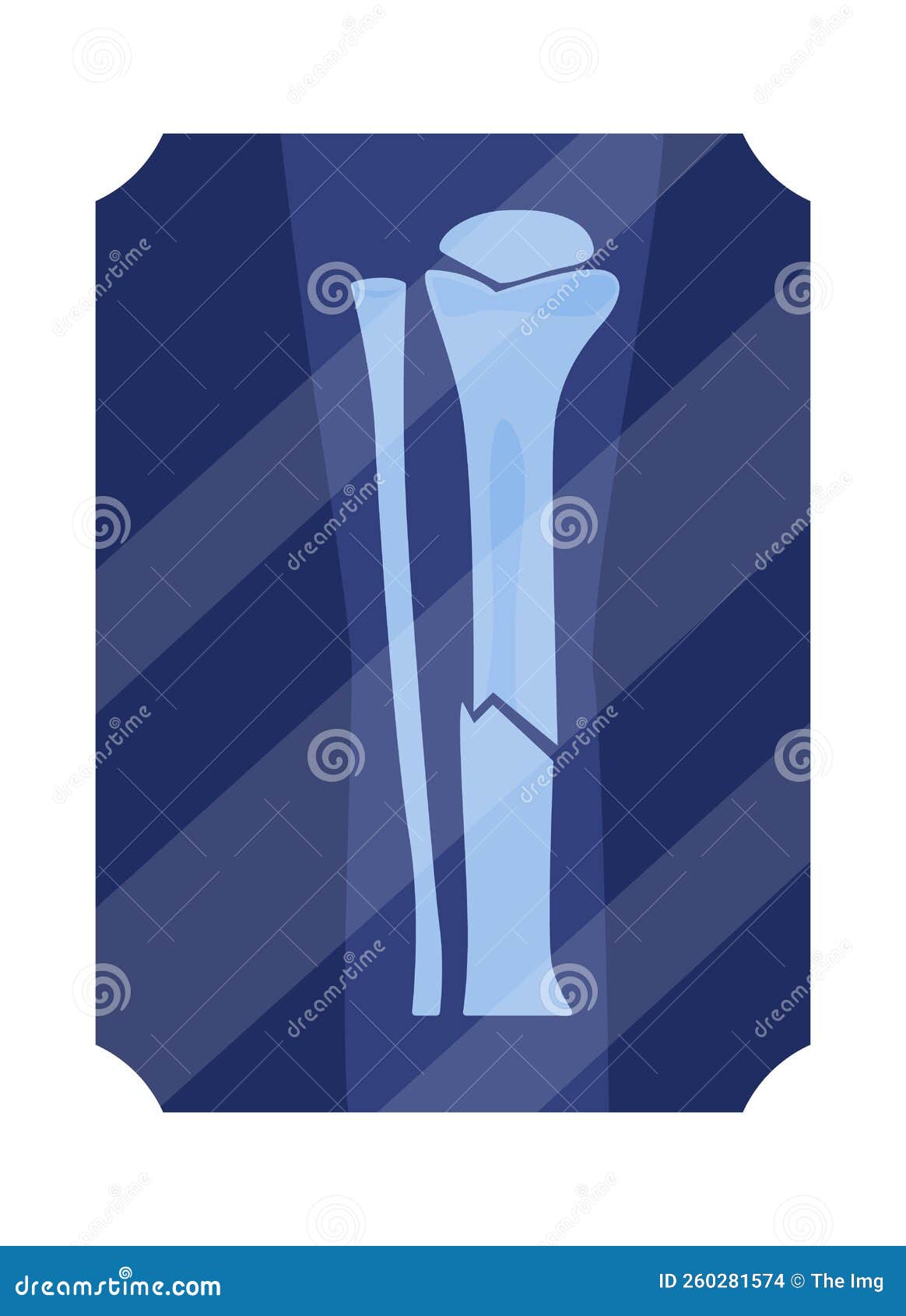 Radiography Test Semi Flat Color Vector Object Stock Vector ...