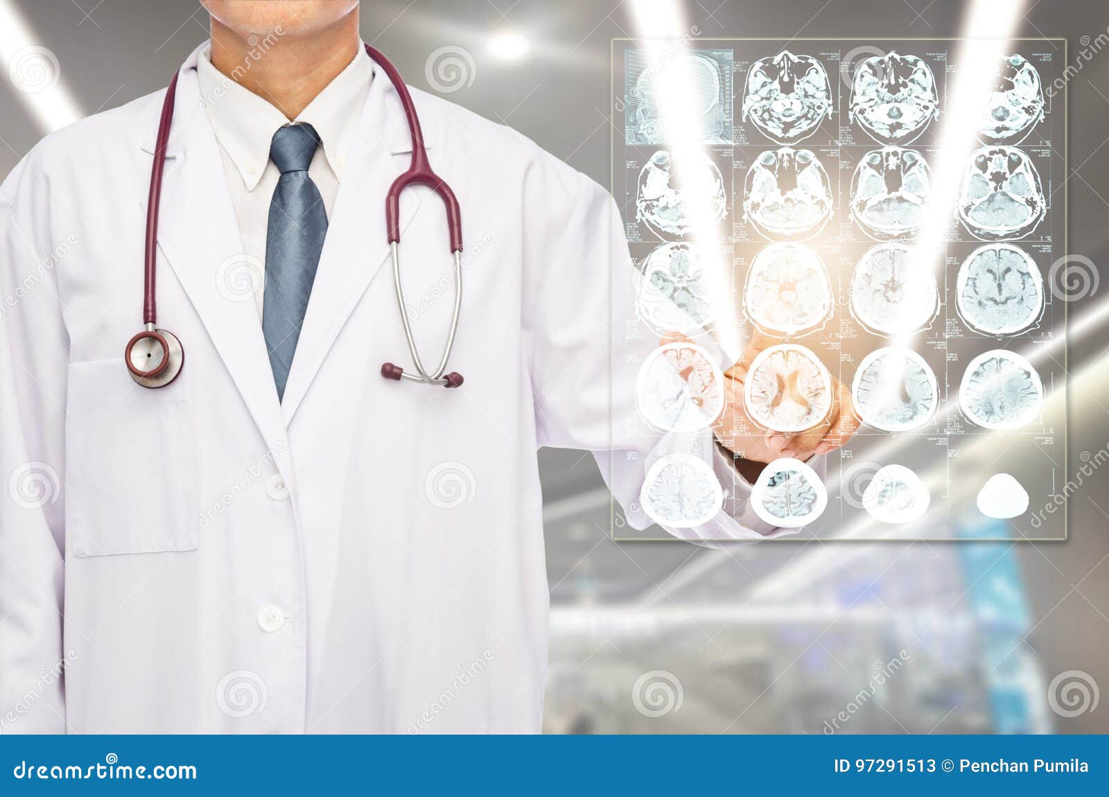 Radiologist Doctor Touching Film Brain MRI. Stock Image | CartoonDealer ... Radiologist Doctor Touching Film Brain MRI. Stock Image | CartoonDealer ...