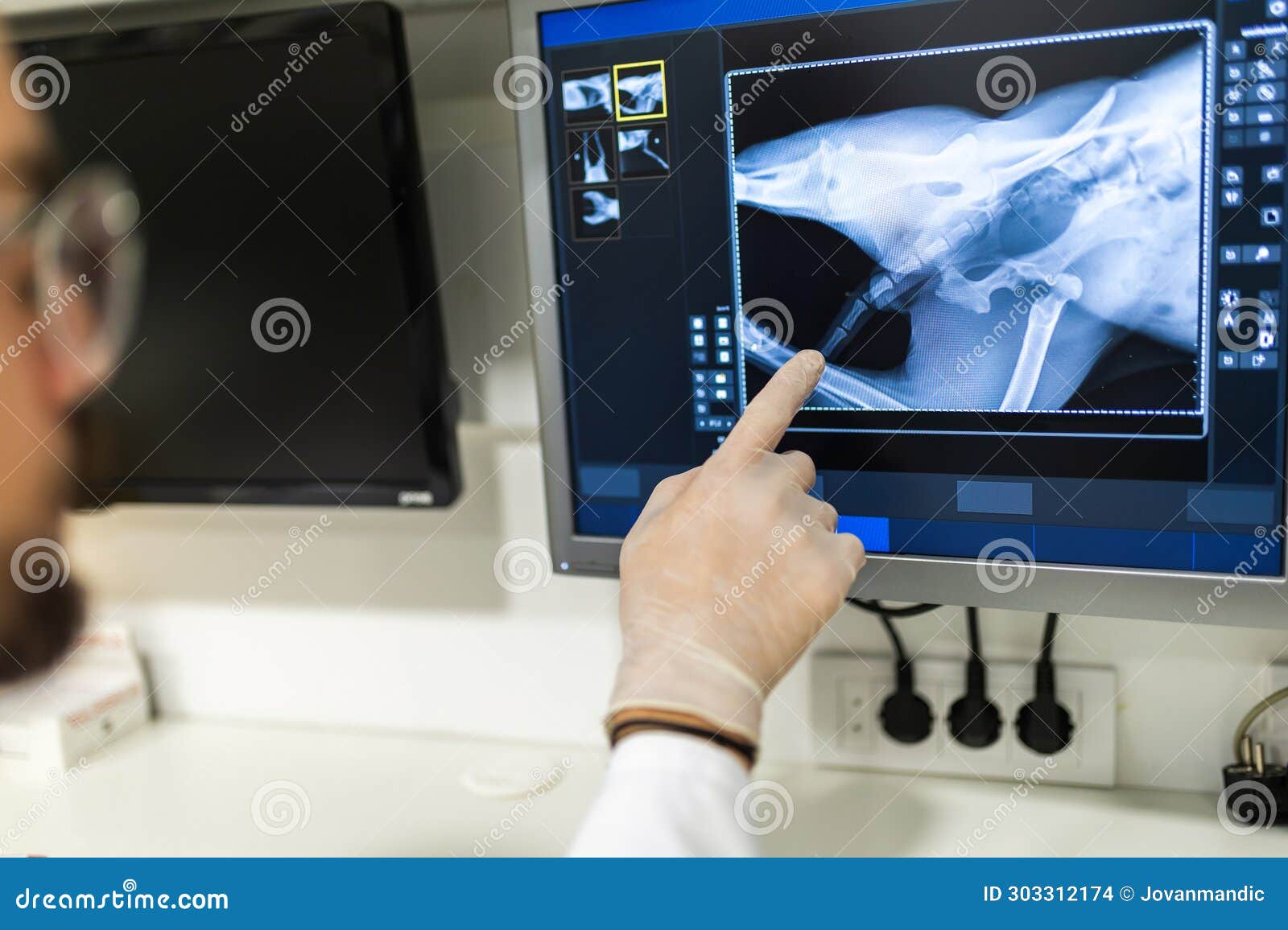 A Radiologist Looks at an X-ray Image Stock Photo - Image of lifestyle ...
