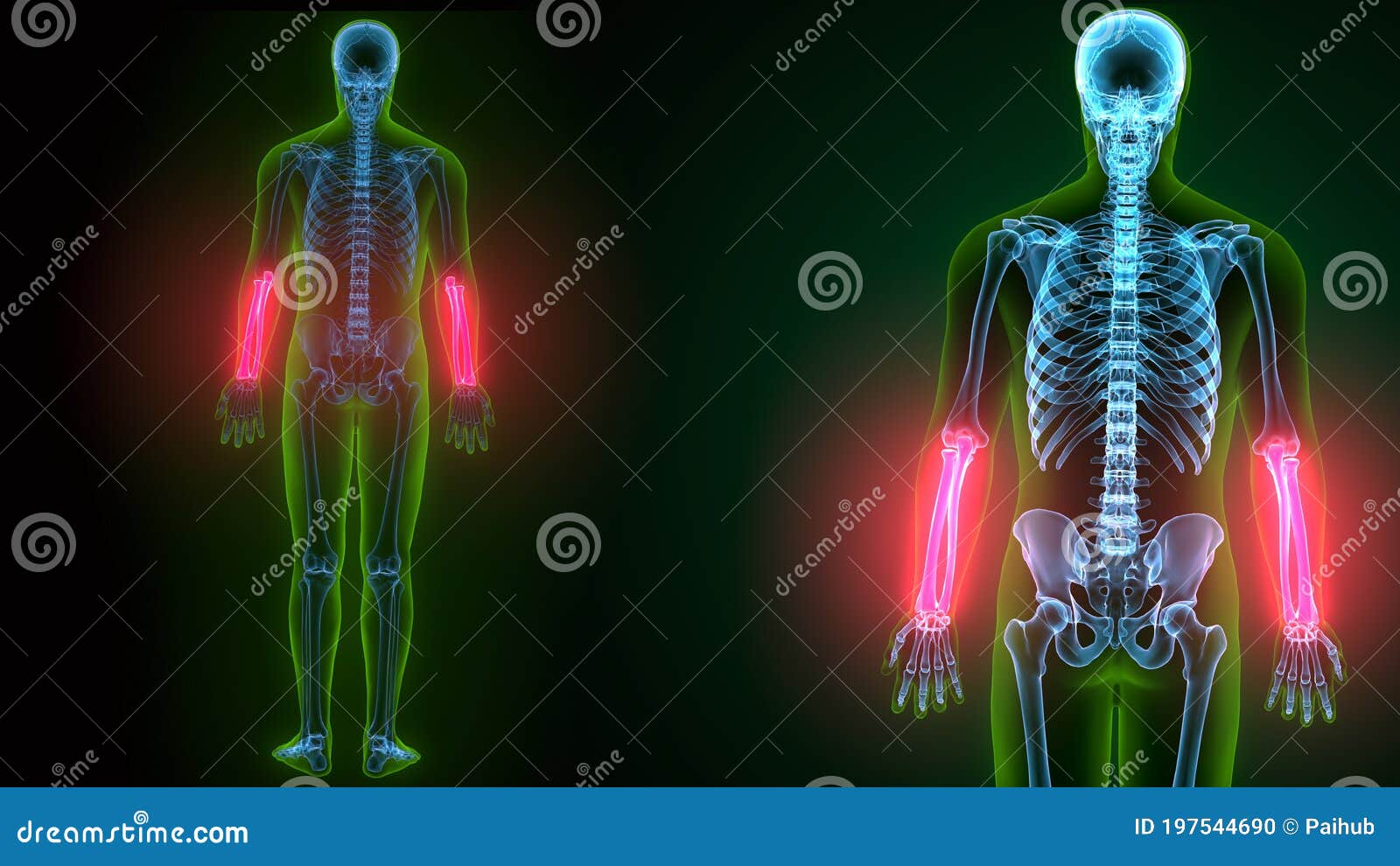 Two Bones Of Forearm - Radius And Ulna. Part Of Human Skeleton ...