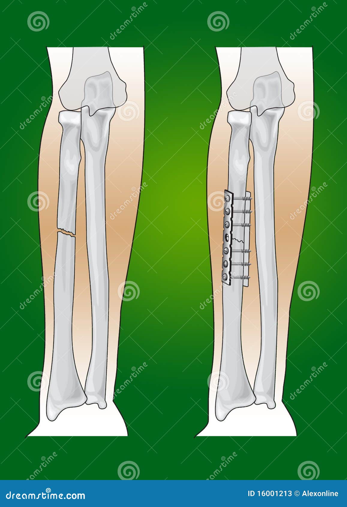 The Radius Royalty-Free Cartoon | CartoonDealer.com #57843383
