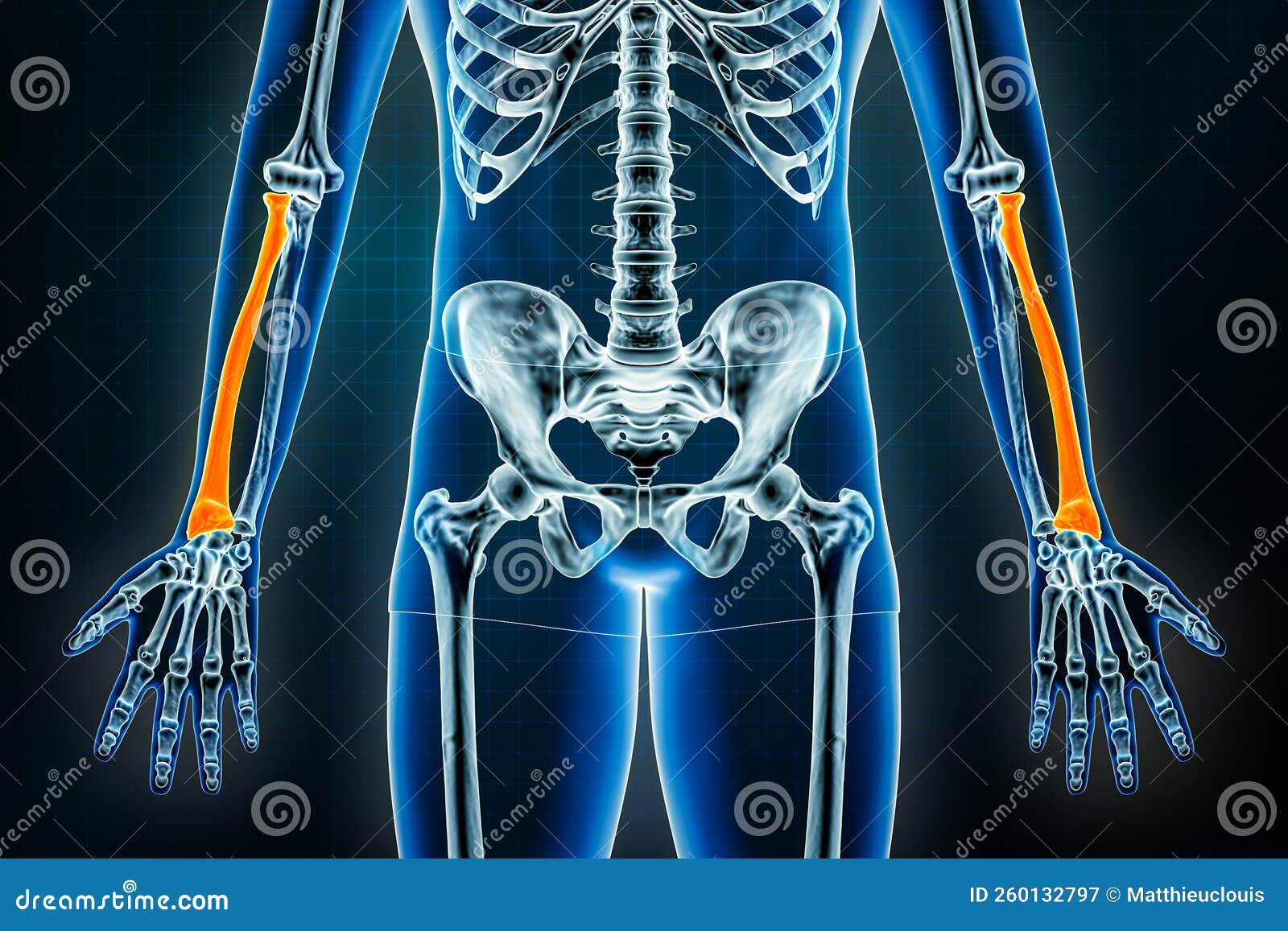 Radius Or Radial Bone X-ray Front Or Anterior View. Osteology Of The ...