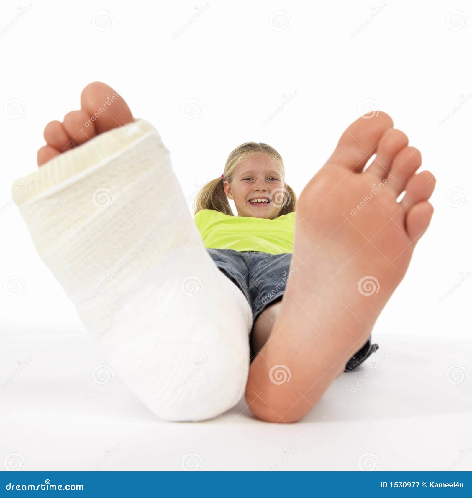 Ragazza Con Un Piedino Rotto Immagine Stock - Immagine di medico, getto ...