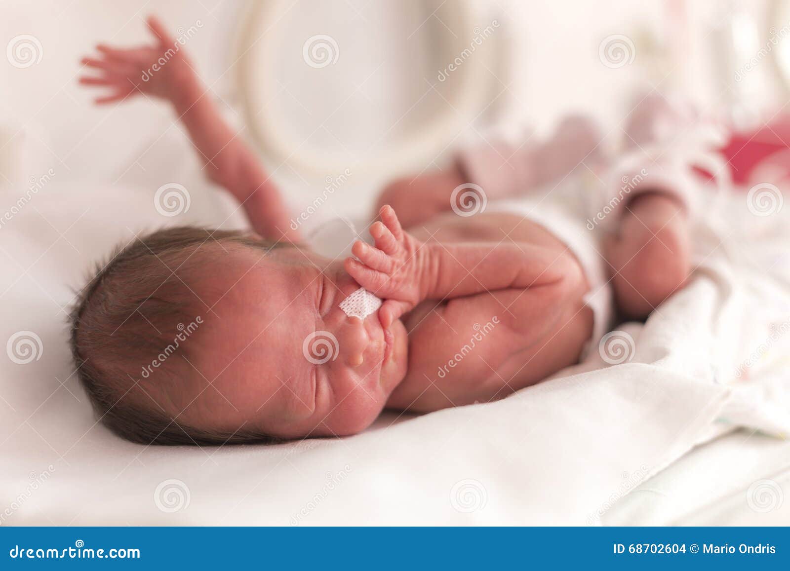 Ragazza Di Neonato Prematura Fotografia Stock - Immagine di famiglia ...