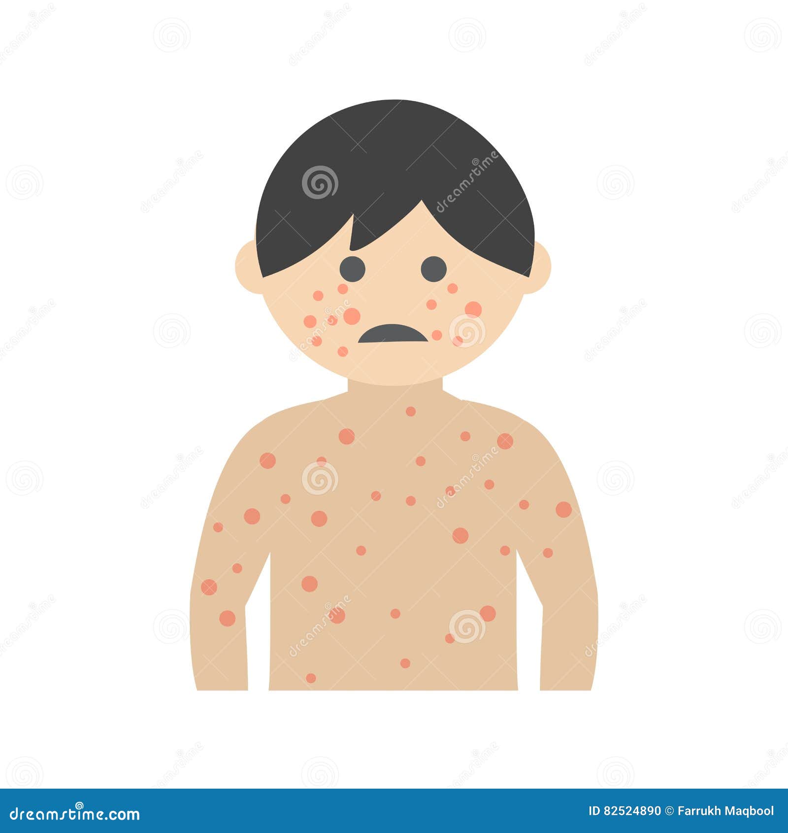 Ragazzo con il morbillo illustrazione di stock. Illustrazione di ...