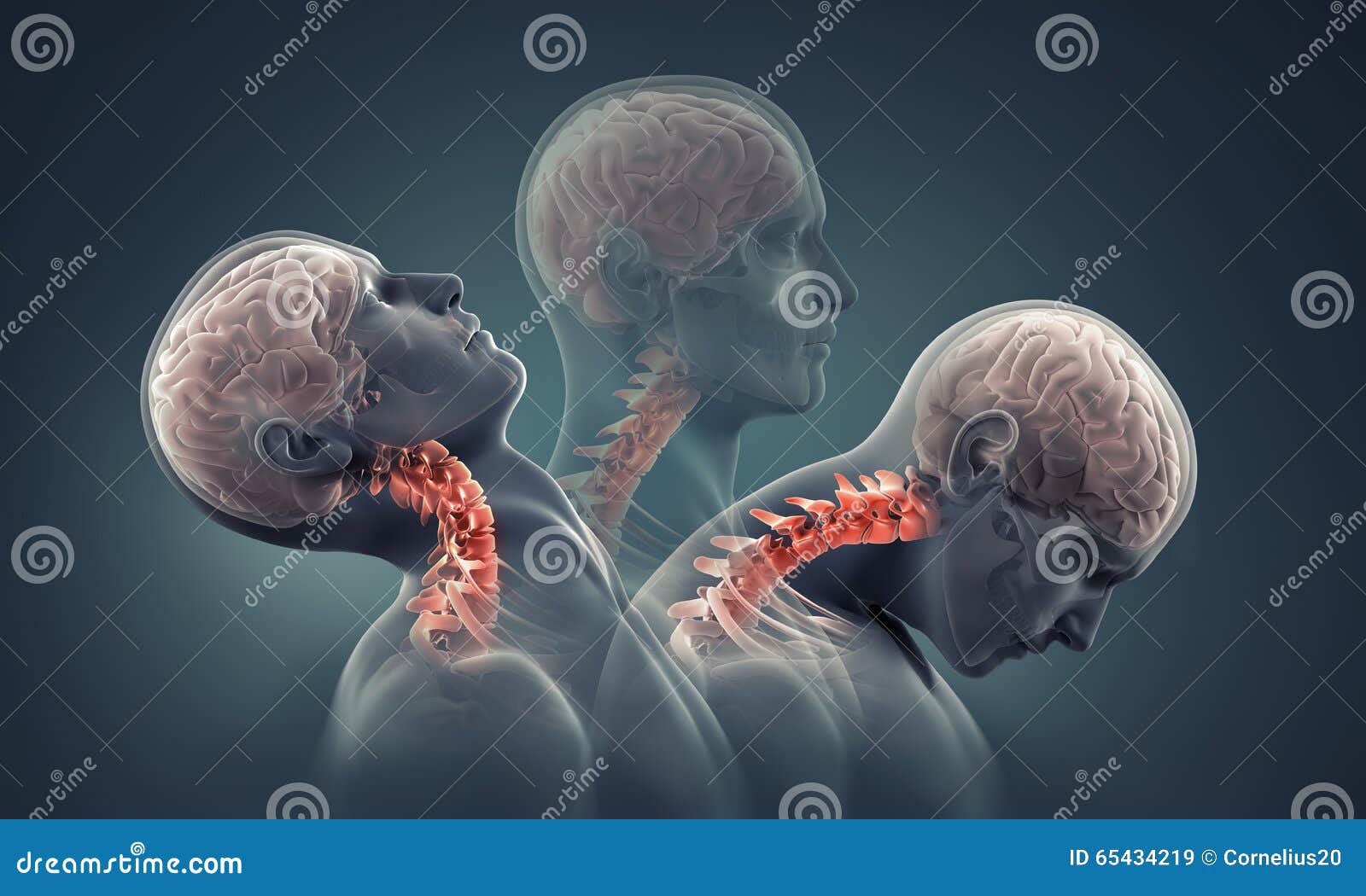 Raggi X Dell'uomo Con Le Ossa Di Collo Evidenziate Immagine Stock ...