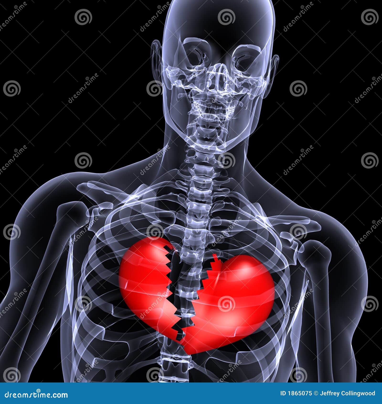 Raggi X Di Scheletro Del Cuore Rotto 1. Illustrazione di Stock ...