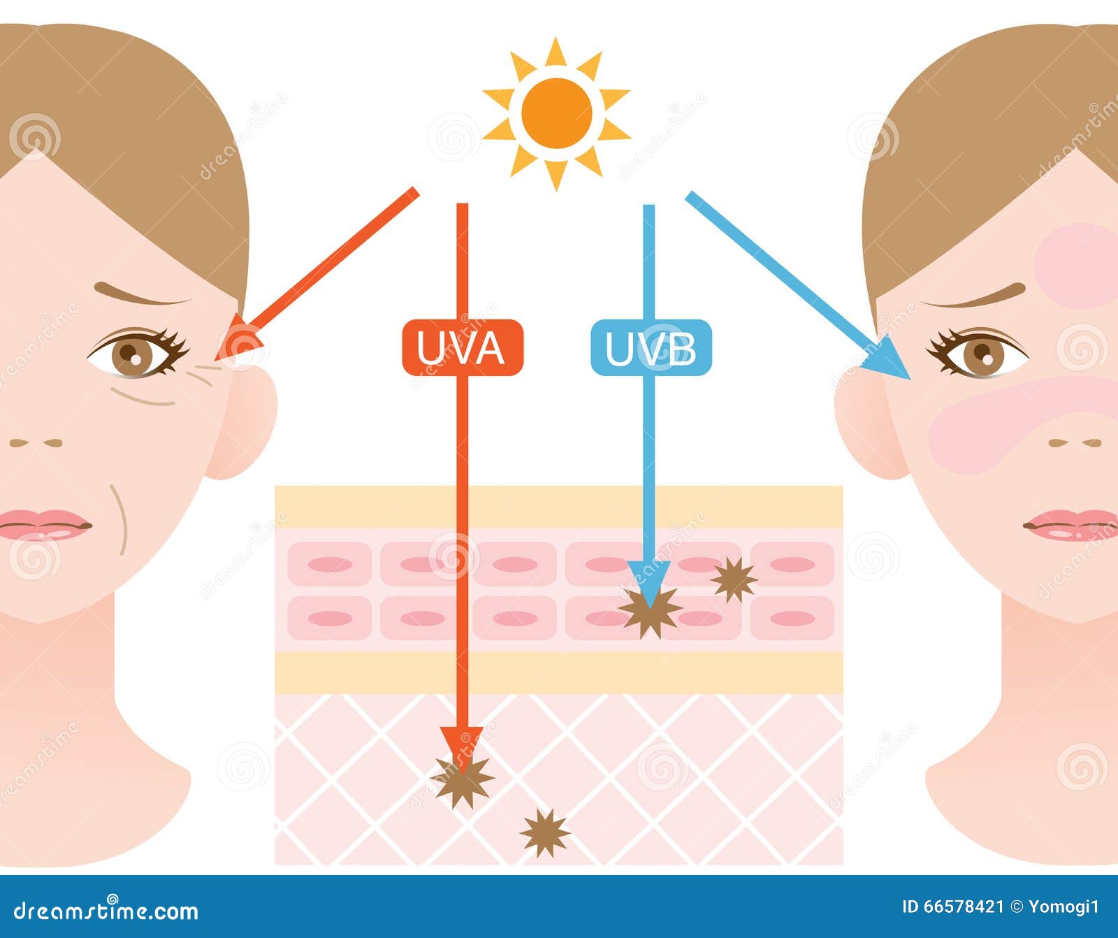 Raggi ultravioletti illustrazione vettoriale. Illustrazione di ...