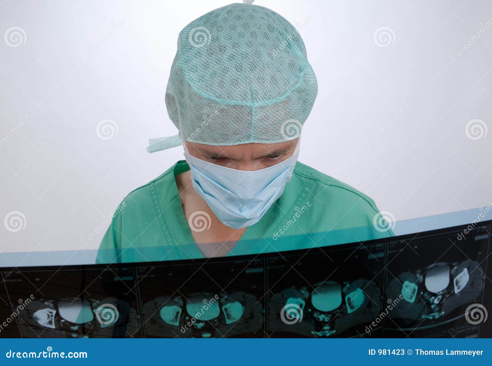 Raggi X immagine stock. Immagine di rontgen, immagine, sguardo - 981423