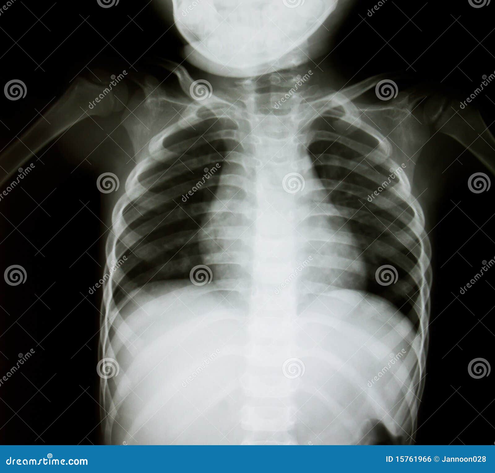 Raio X De Caixa Do Menino Novo Imagem de Stock Royalty Free - Imagem ...