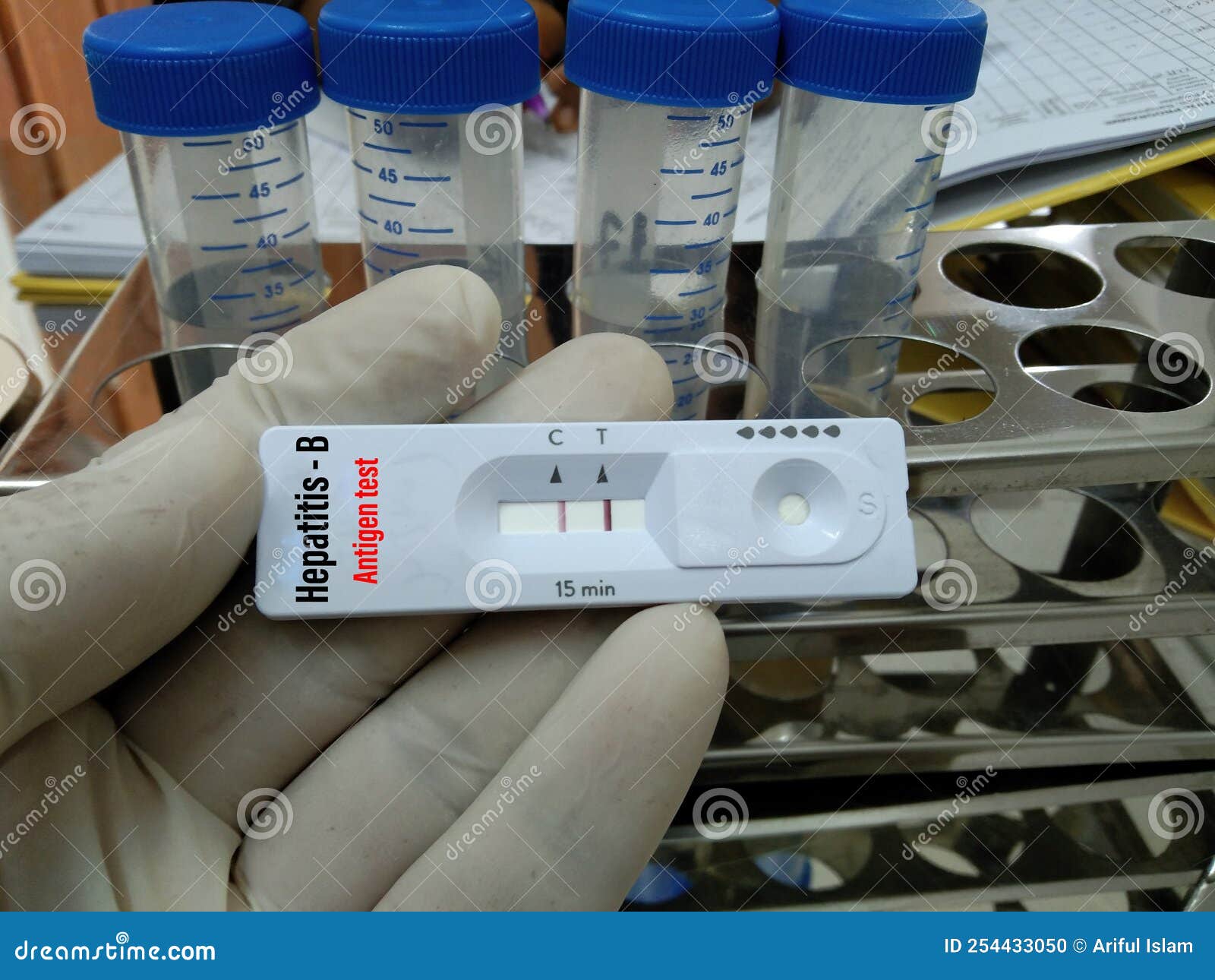 Rapid Test Cassette for Hepatitis B Virus Test at Medical Laboratory ...