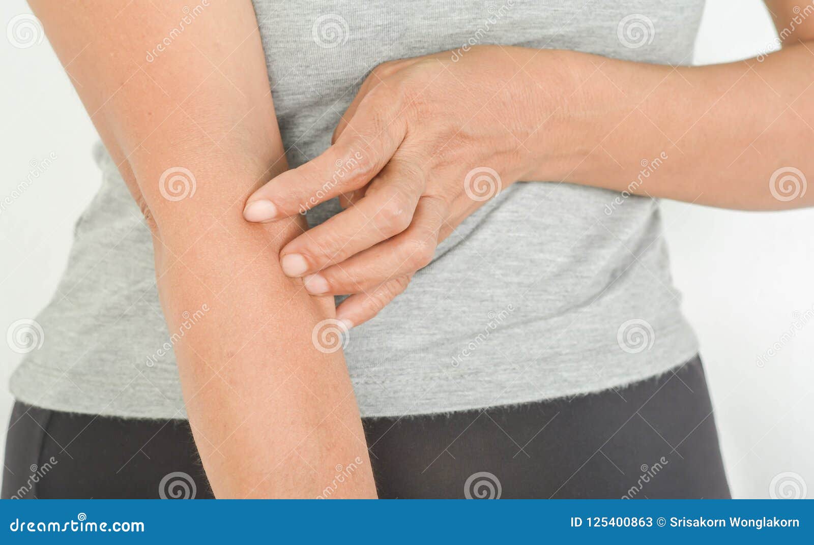 Rash on the arm stock image. Image of painful, scratch - 125400863