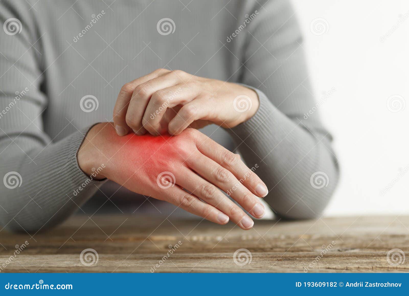 Rash and Irritation on the Skin of the Hands, Itching. Dermatological ...
