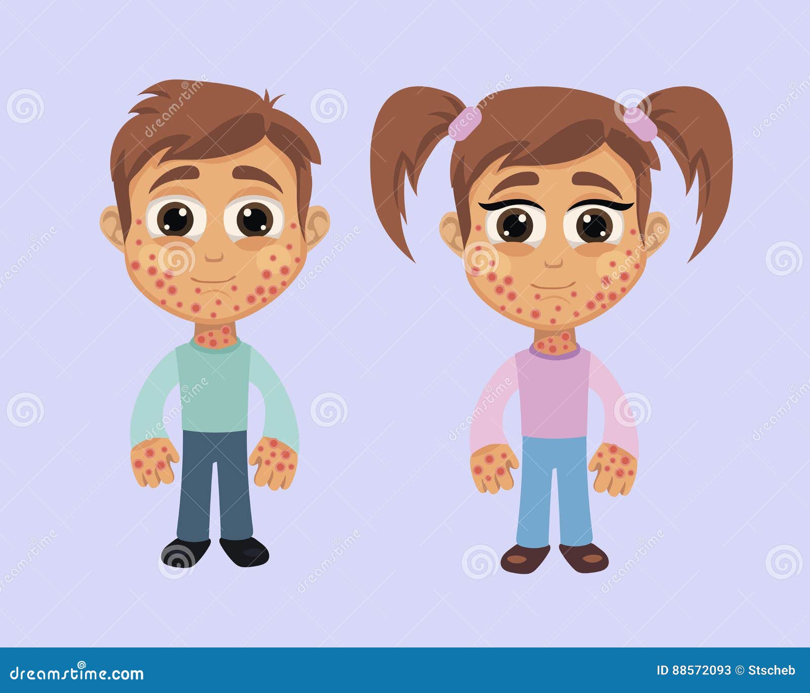 Rash In Children. Allergy Vector Illustration | CartoonDealer.com #32866212