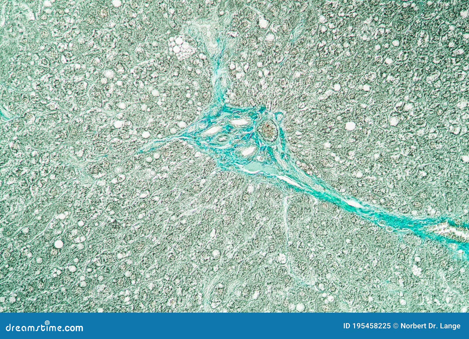 Rat liver tissue section stock image. Image of enlargement - 195458225