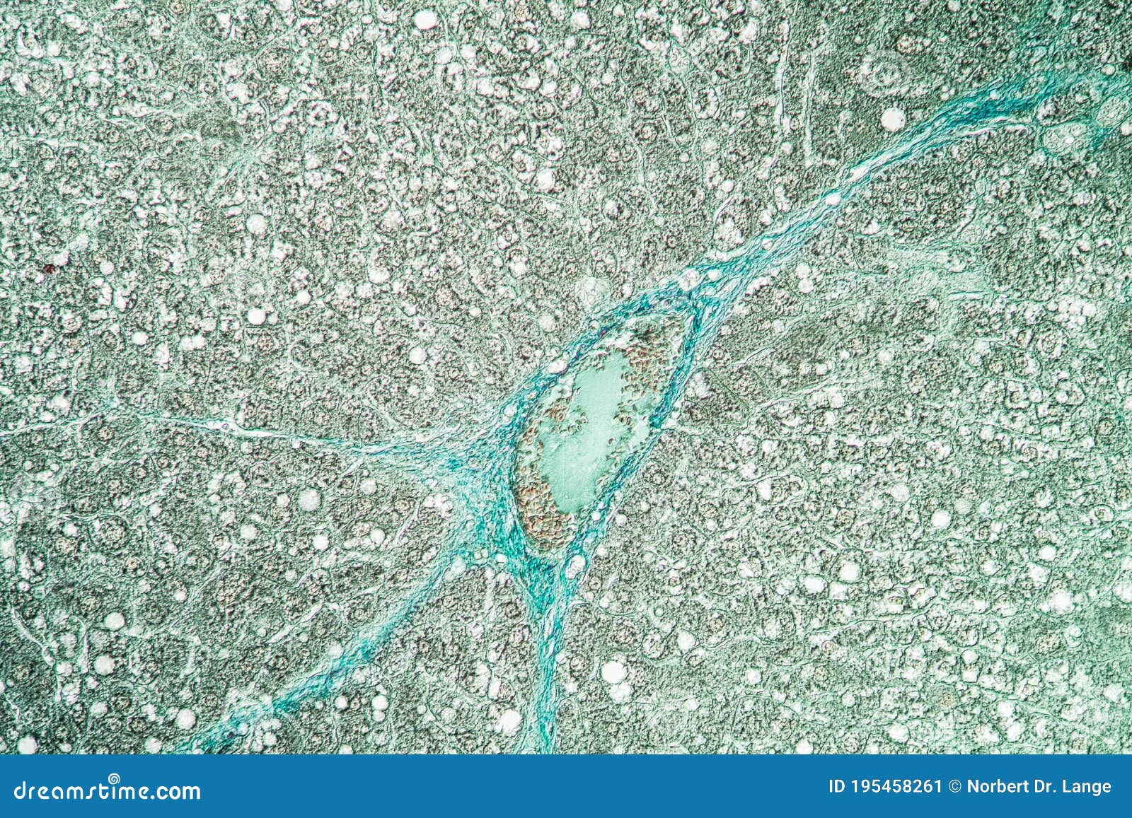 Rat liver tissue section stock image. Image of science - 195458261