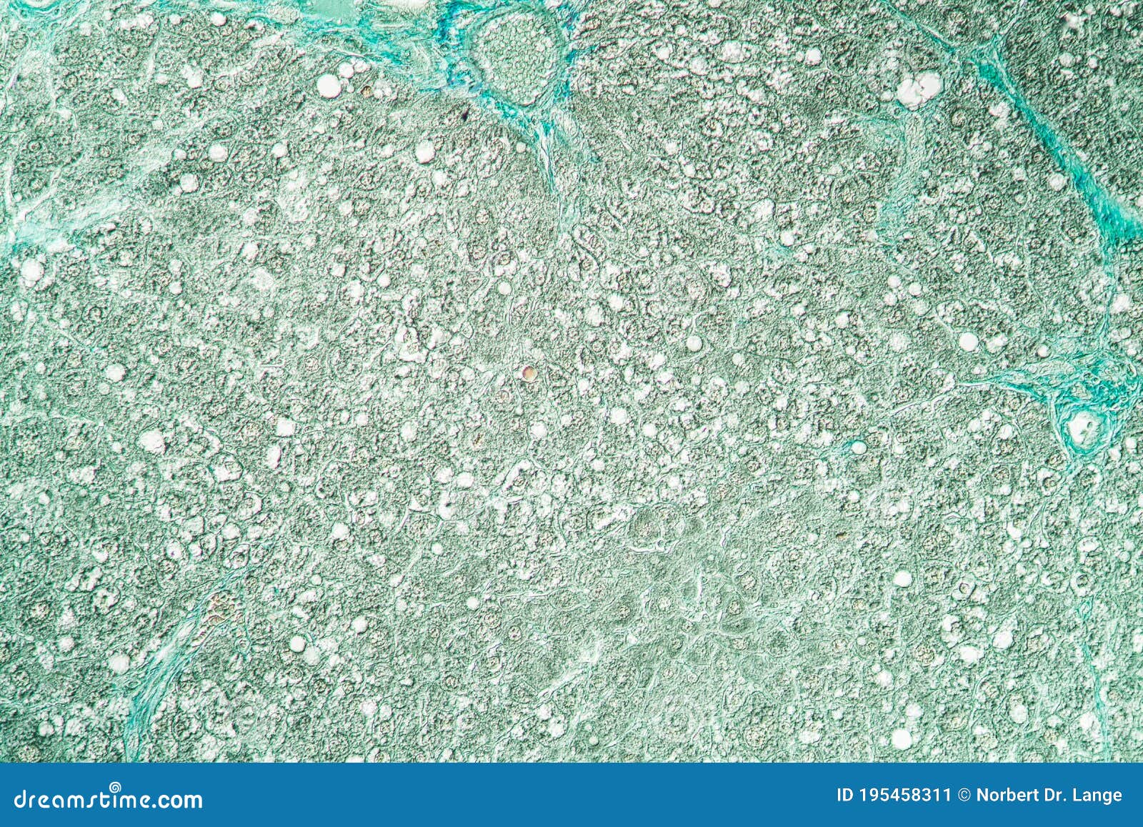 Rat liver tissue section stock image. Image of science - 195458311