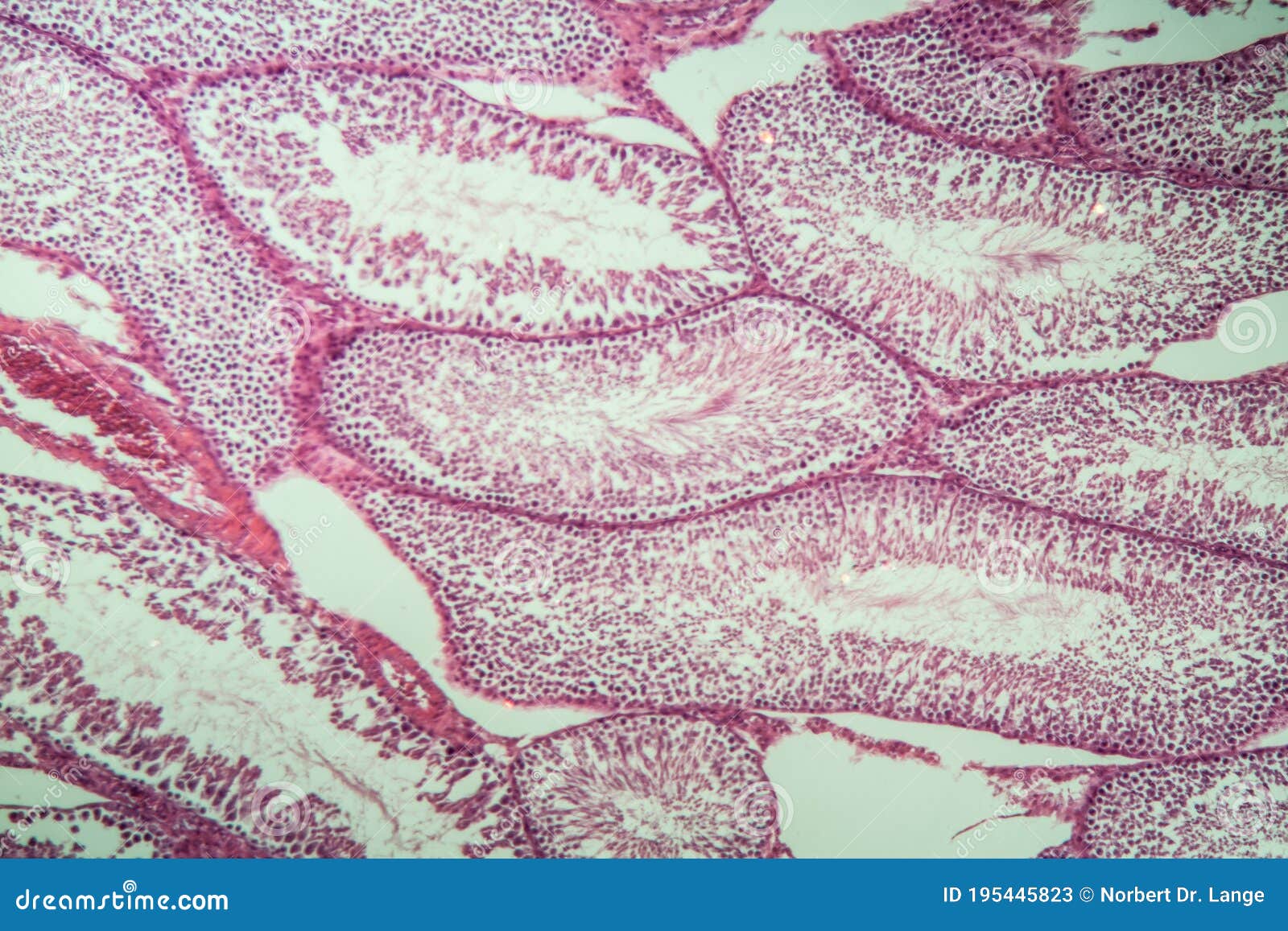 Rat Testicles with Sperm Tissue in Cross Section Stock Image - Image of ...