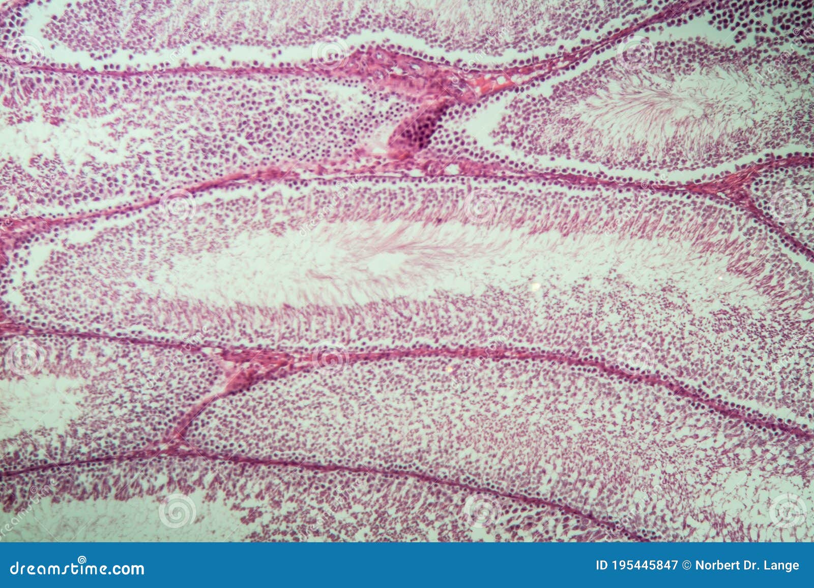 Rat Testicles with Sperm Tissue in Cross Section Stock Image - Image of ...