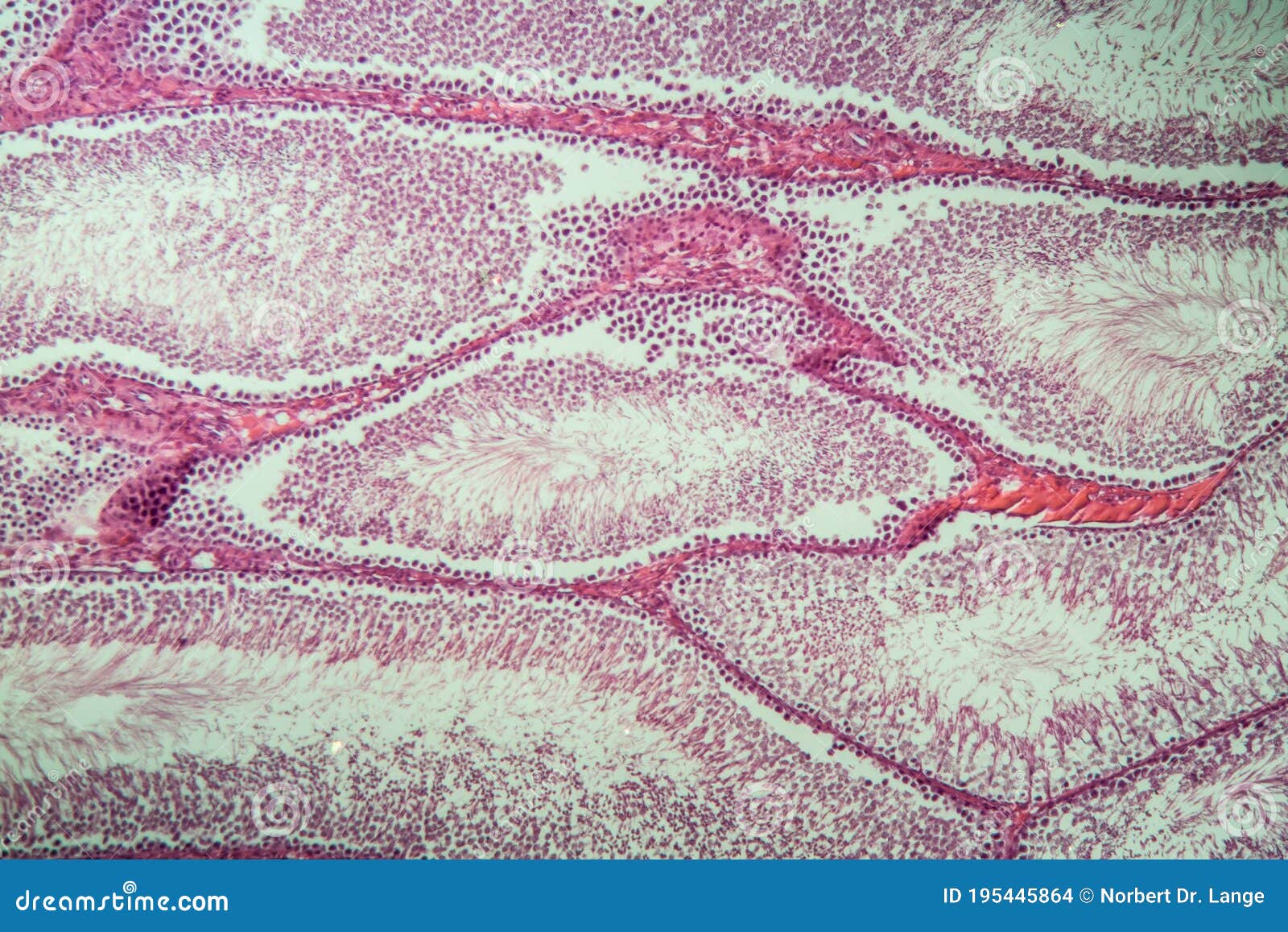 Rat Testicles with Sperm Tissue in Cross Section Stock Photo - Image of ...