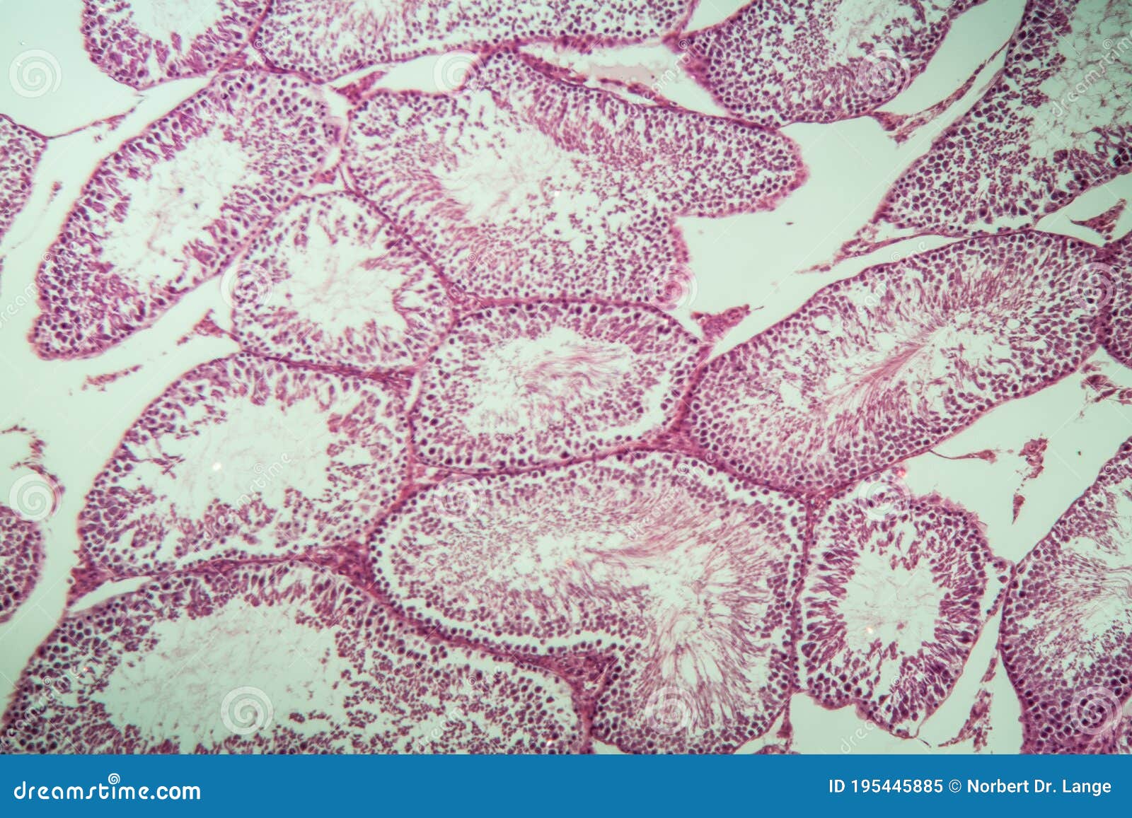 Rat Testicles with Sperm Tissue in Cross Section Stock Image - Image of ...