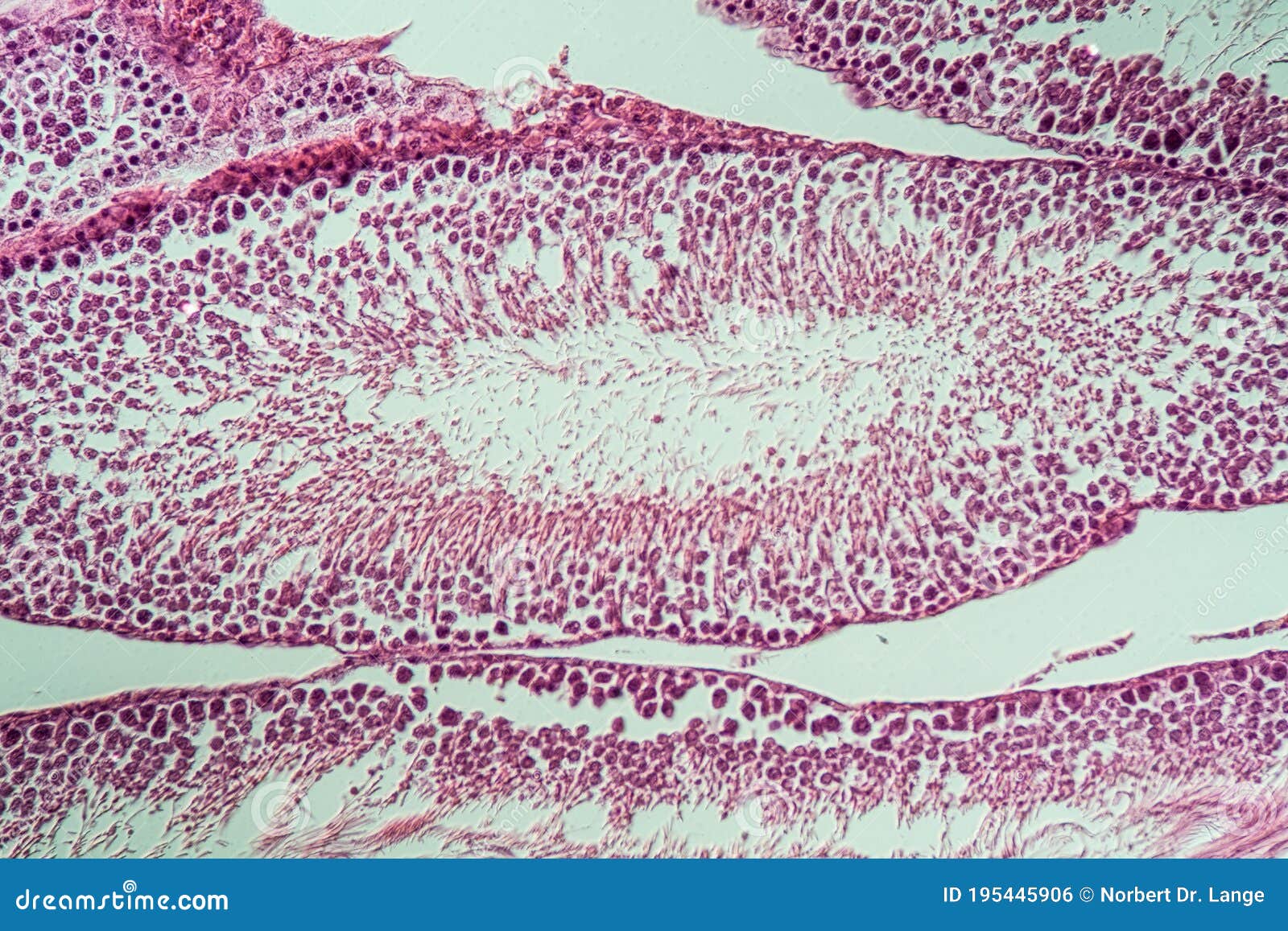 Rat Testicles With Sperm Tissue In Cross Section Royalty-Free Stock ...