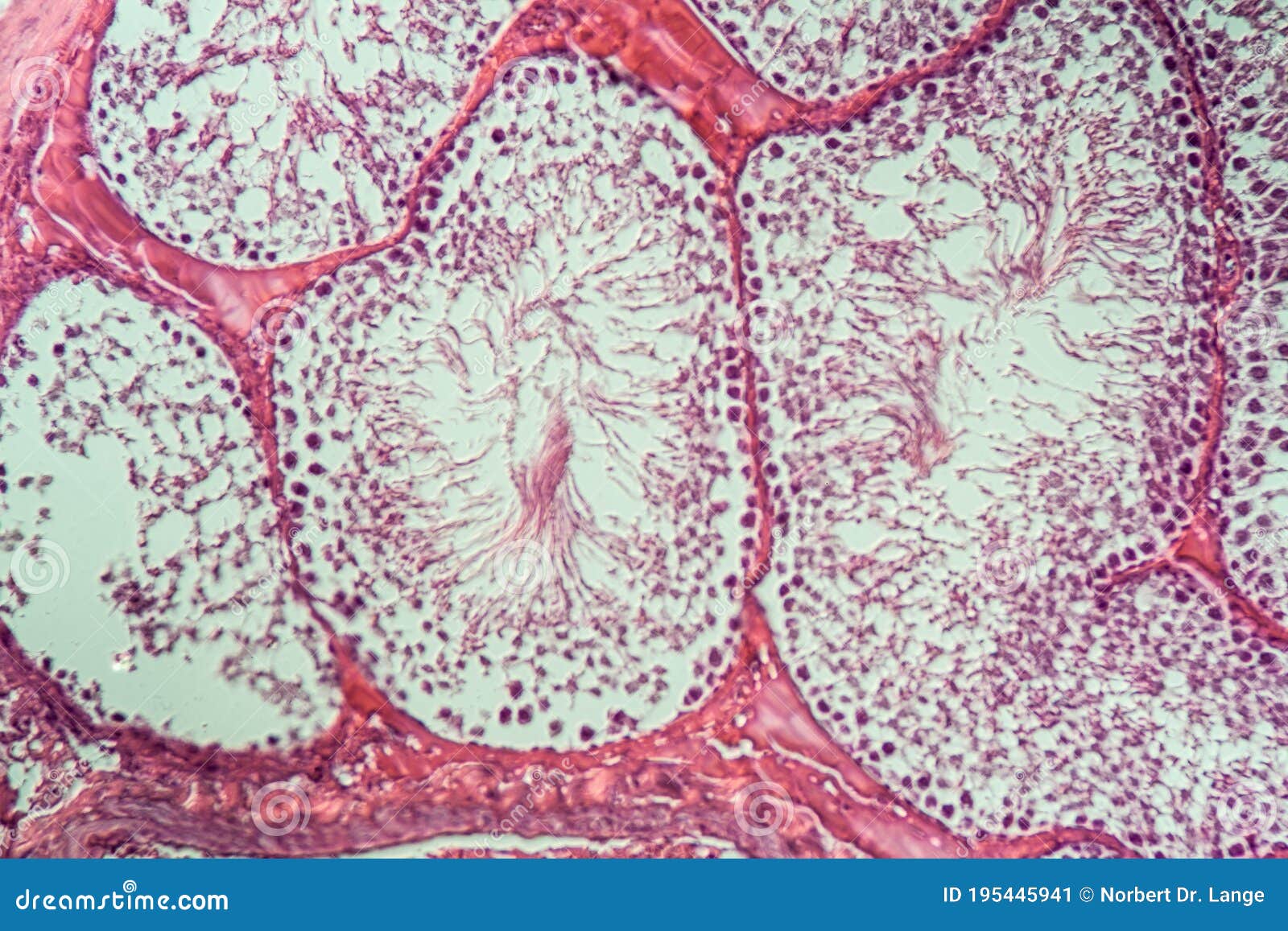 Rat Testicles With Sperm Tissue In Cross Section Royalty-Free Stock ...
