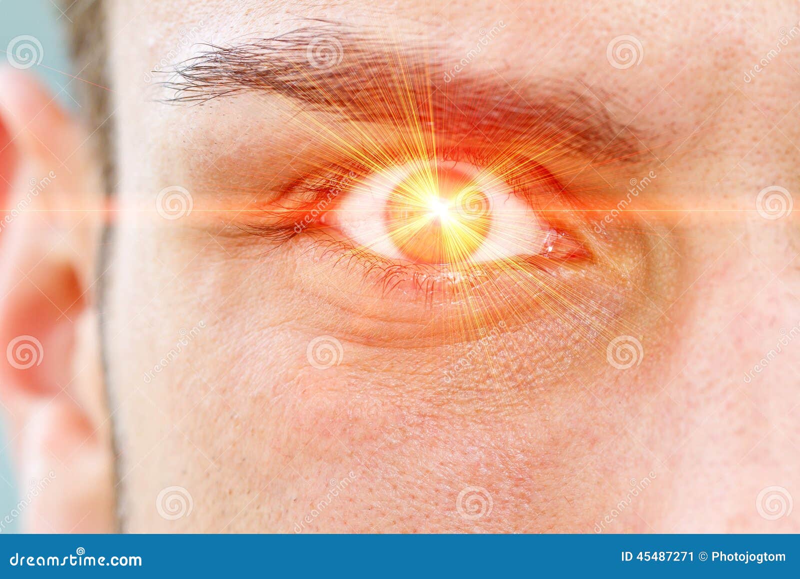 Rayo del laser en ojo imagen de archivo. Imagen de negocios - 45487271