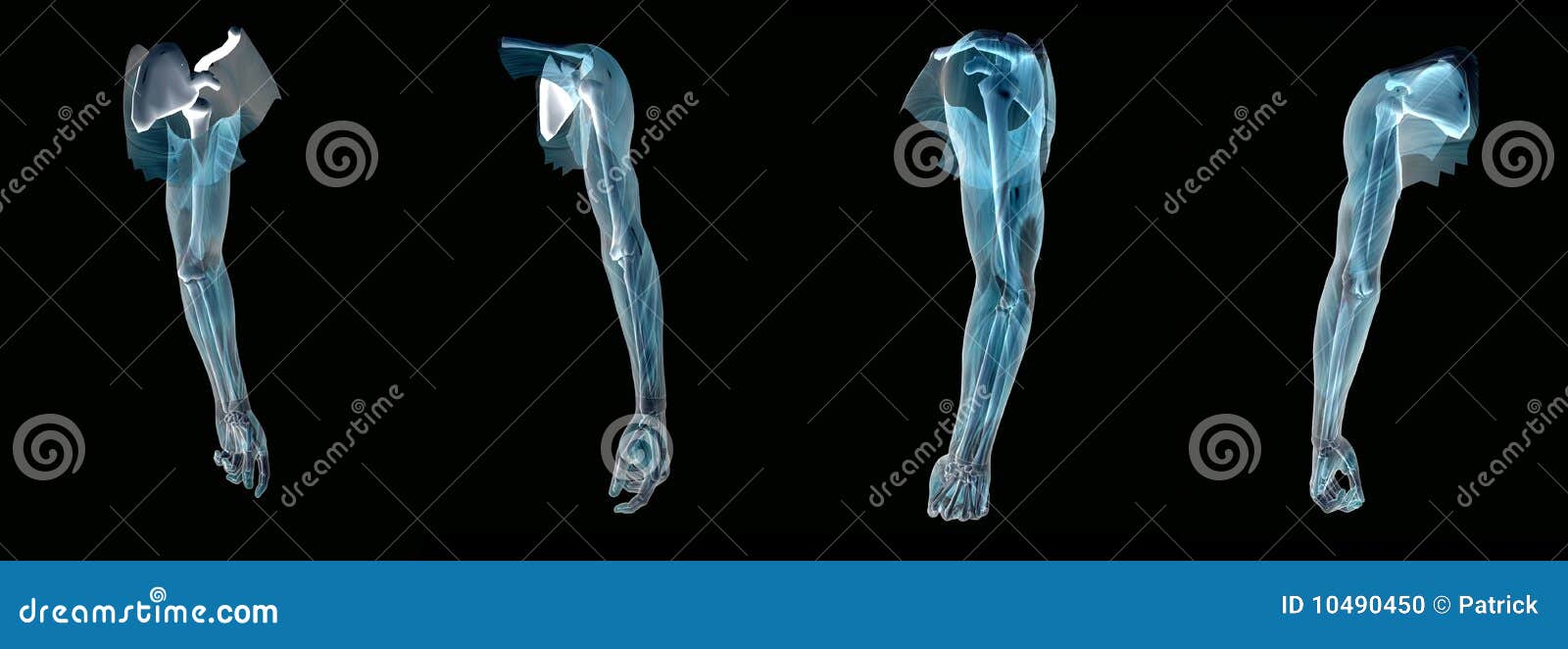 Rayon de bras d'anatomie X illustration stock. Illustration du muscle ...