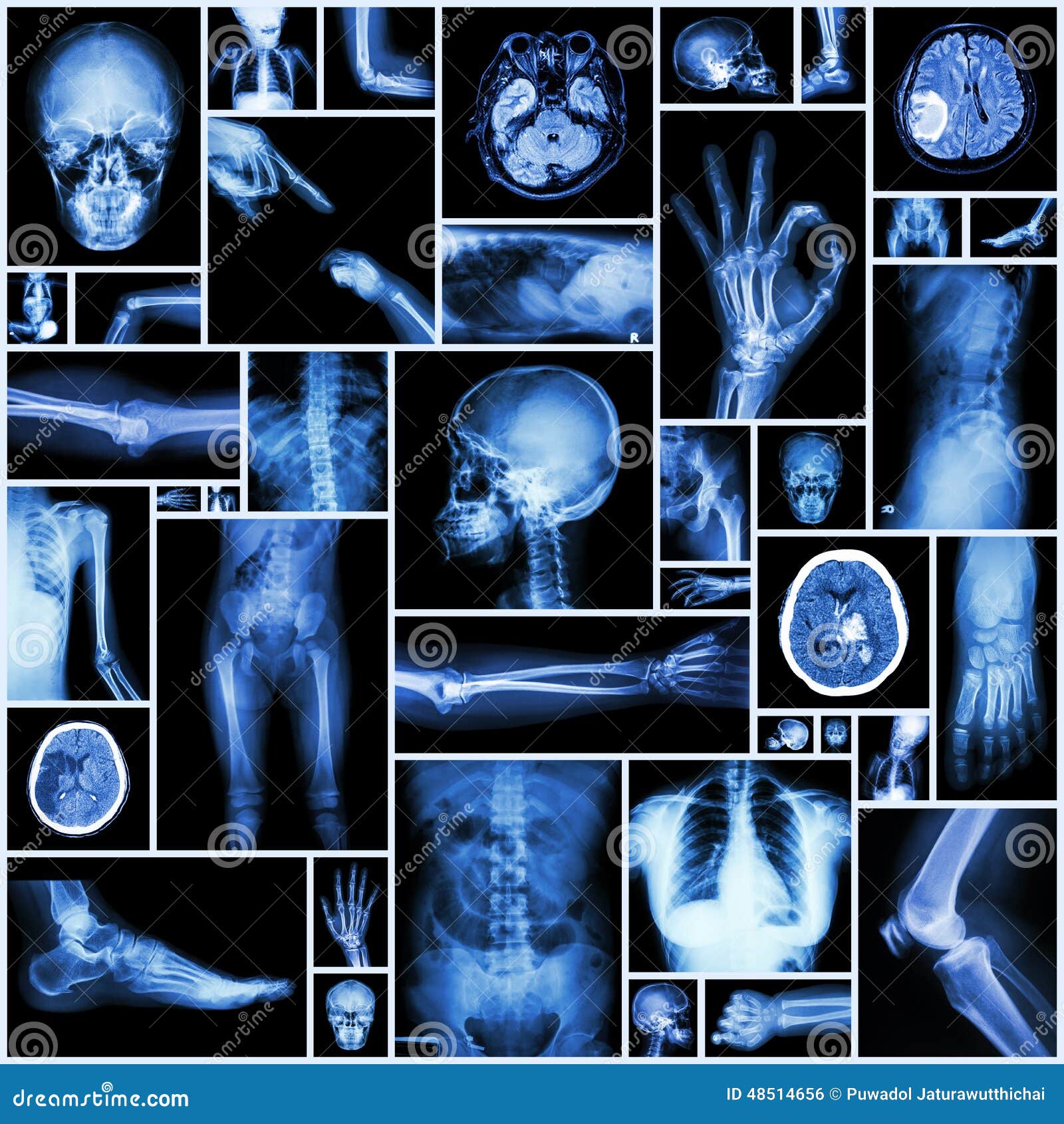 Rayon X Multipart De L'humain Illustration Stock - Illustration du ...