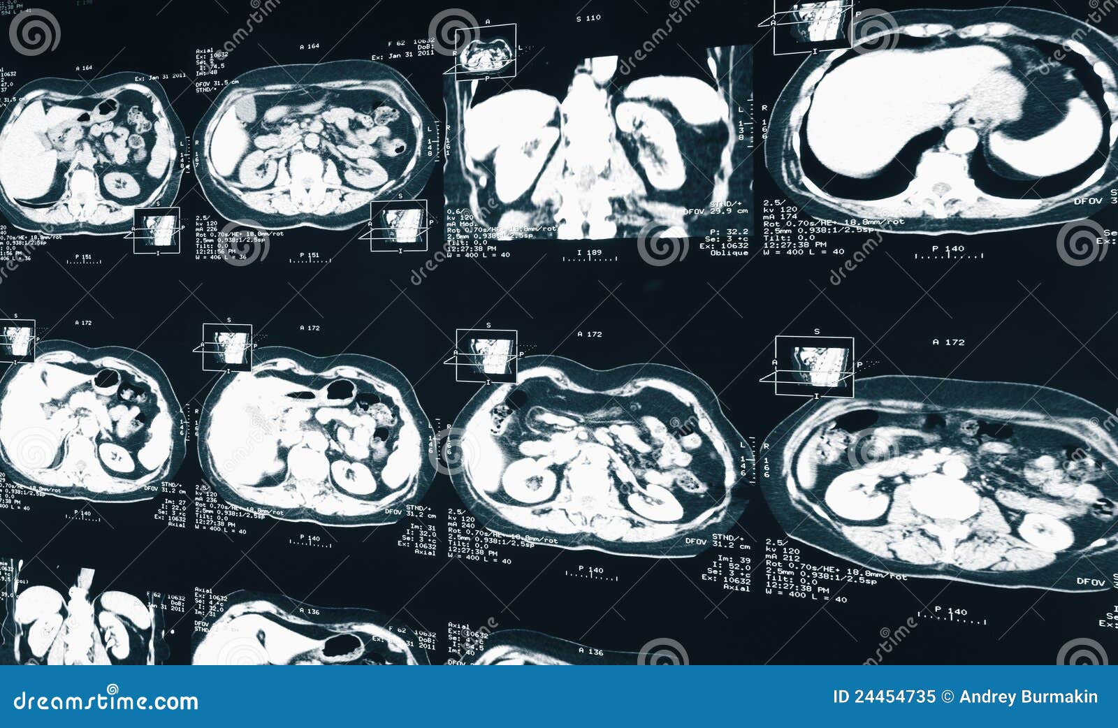 Rayon X image stock. Image du rayonnement, radiographie - 24454735