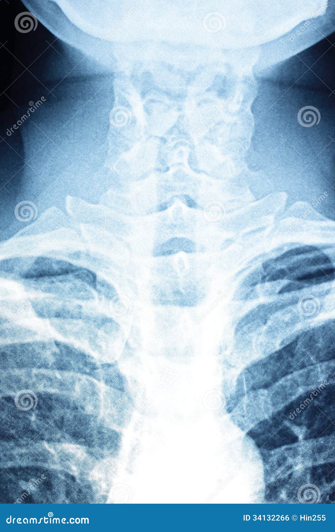 Rayon X photo stock. Image du radiologique, radiographie - 34132266