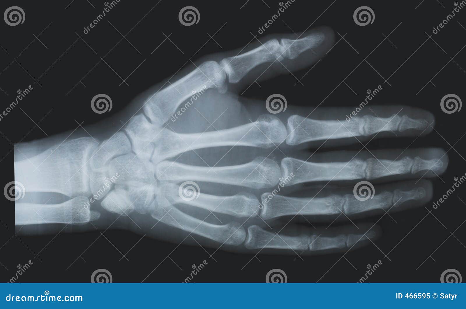 Rayon X image stock. Image du radiologie, inspection, docteur - 466595