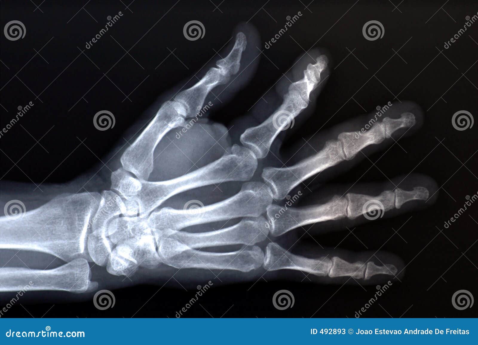 Rayon X image stock. Image du hôpital, docteur, main, radiologique - 492893