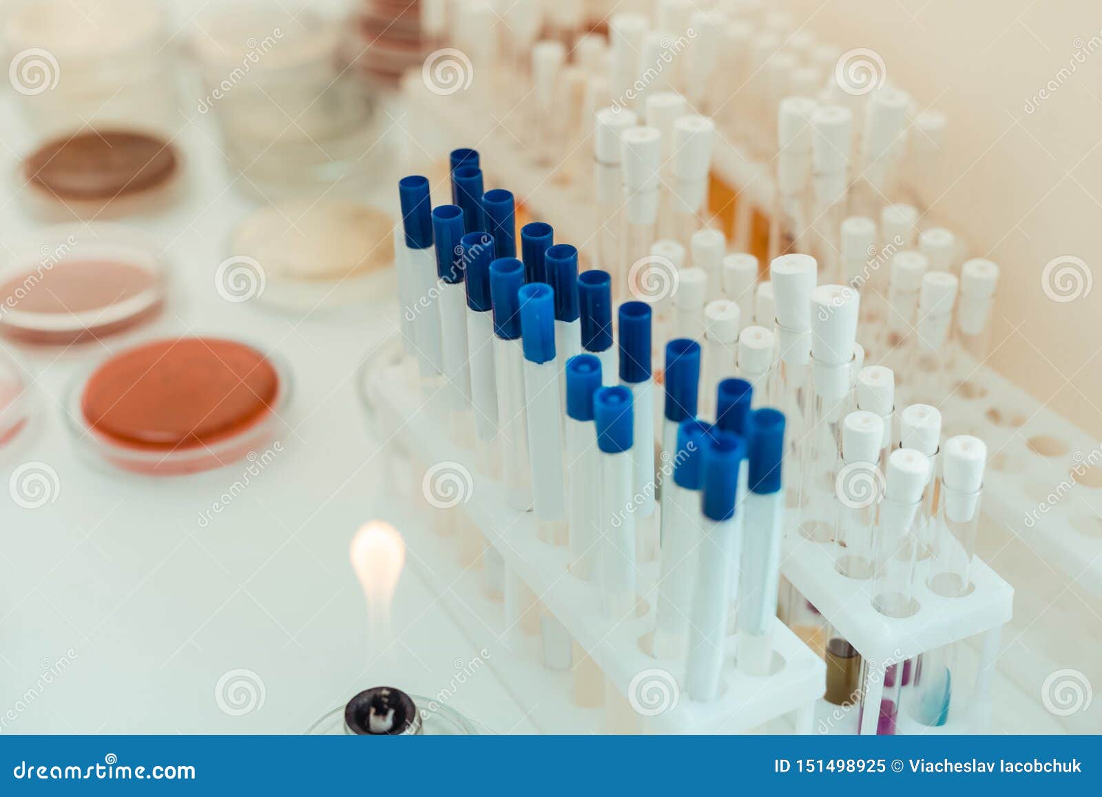 Top View of Closed Test Tubes in the Rack Stock Image - Image of ...