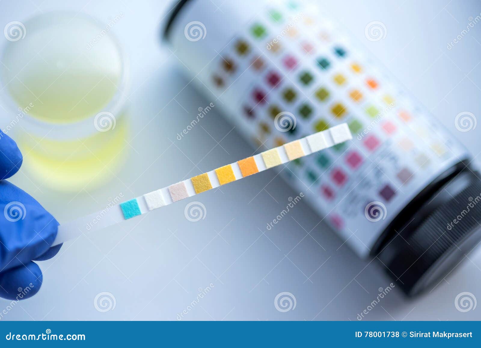 Reagent Strip for Urinalysis , Routine Urinalysis, Check-up Anal Stock ...
